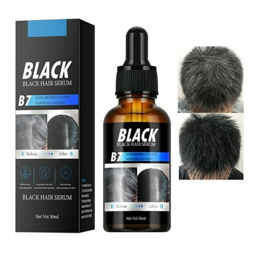 Blue Magic Castor Oil, 12 oz, Hair Treatment, Herbal Nourishment ...