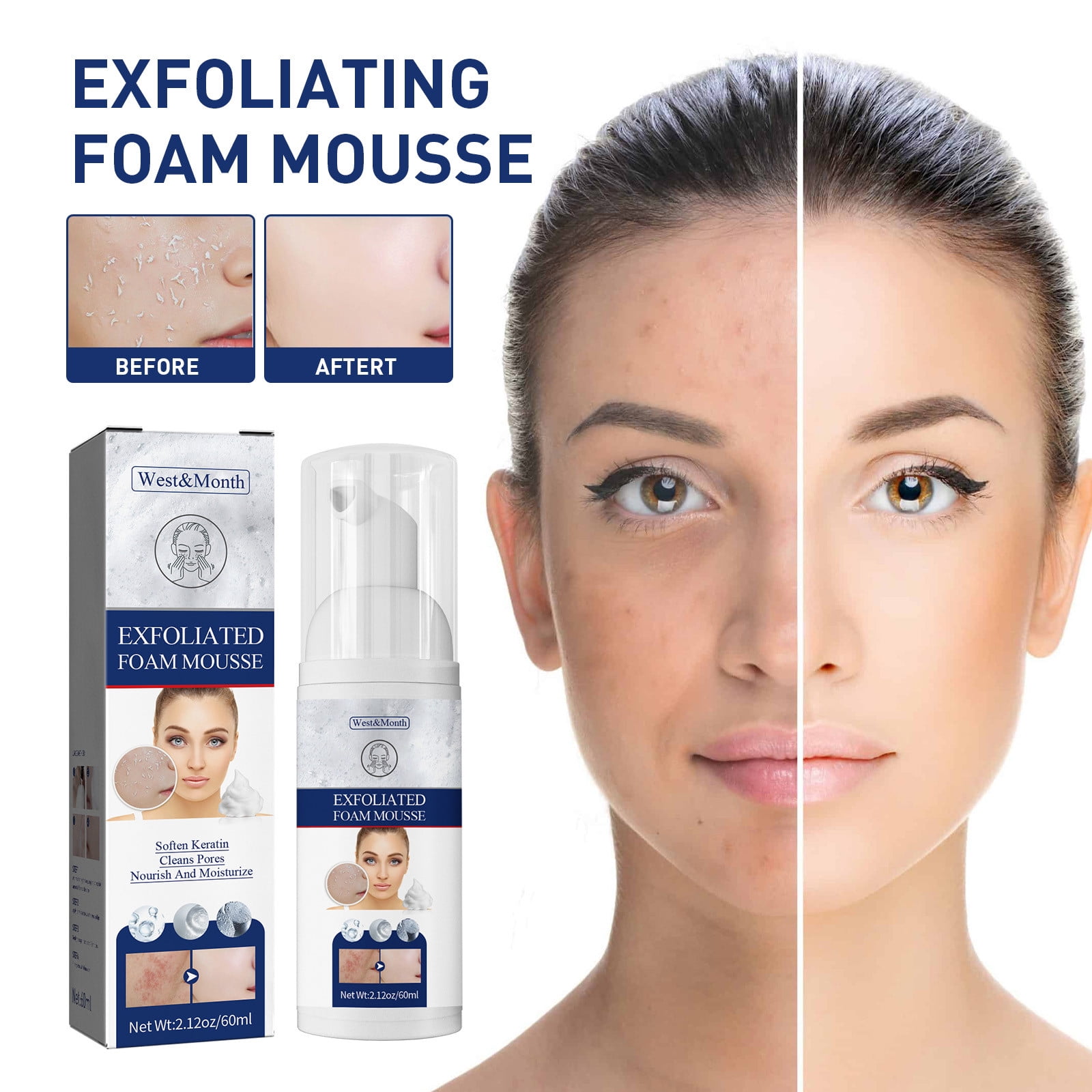 CHOII Excellent Green Peeling Oil Lightening Exfoliating, Green Peeling ...