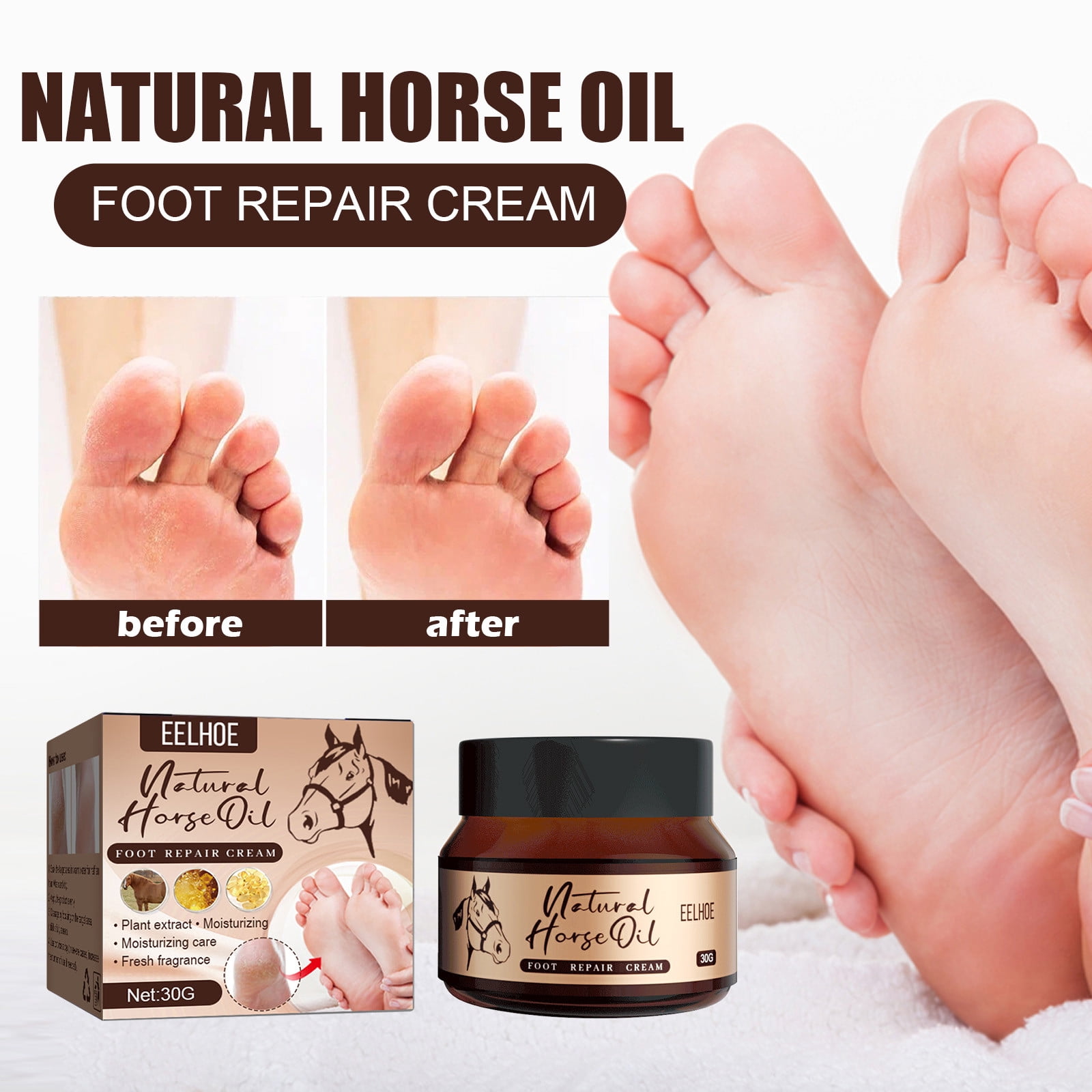 CHOII Urea Foot Urea Foot Lotion Hydrates, Callus Remover Moisturizes ...