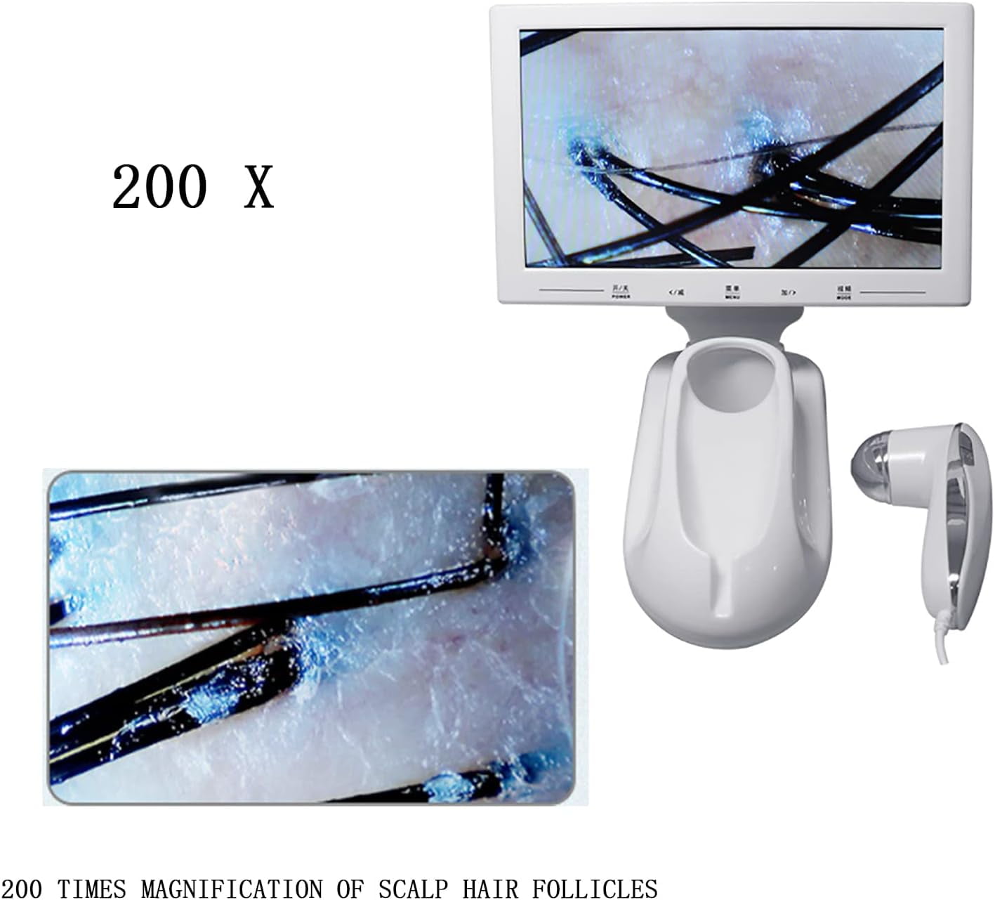 CNV Skin Diagnosis Hair Analyzer, 11 Inch LCD Screen Scalp Hair Follicle Hair Skin Analyser ...