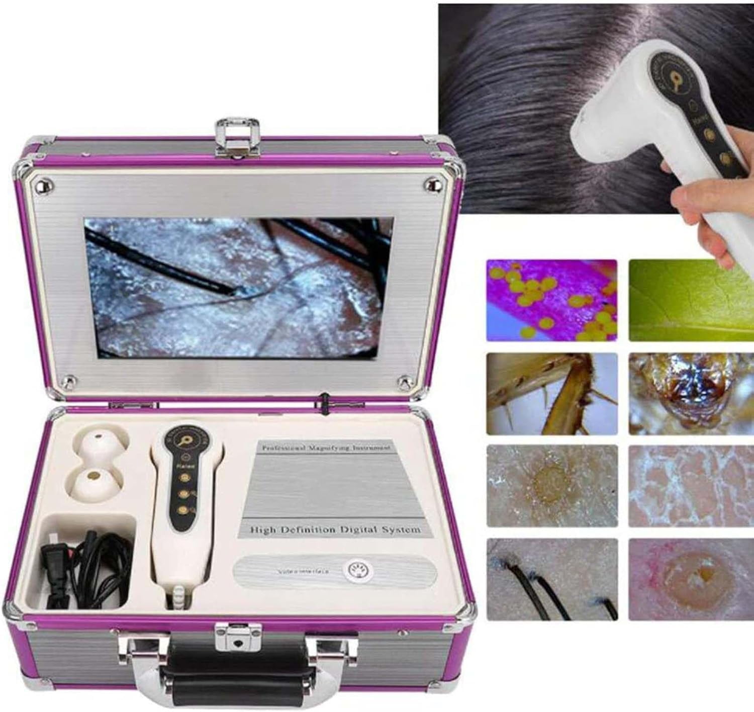 CNV Skin Diagnosis Hair Analyzer,9 Inch 50x 200x Charging Type Scalp ...
