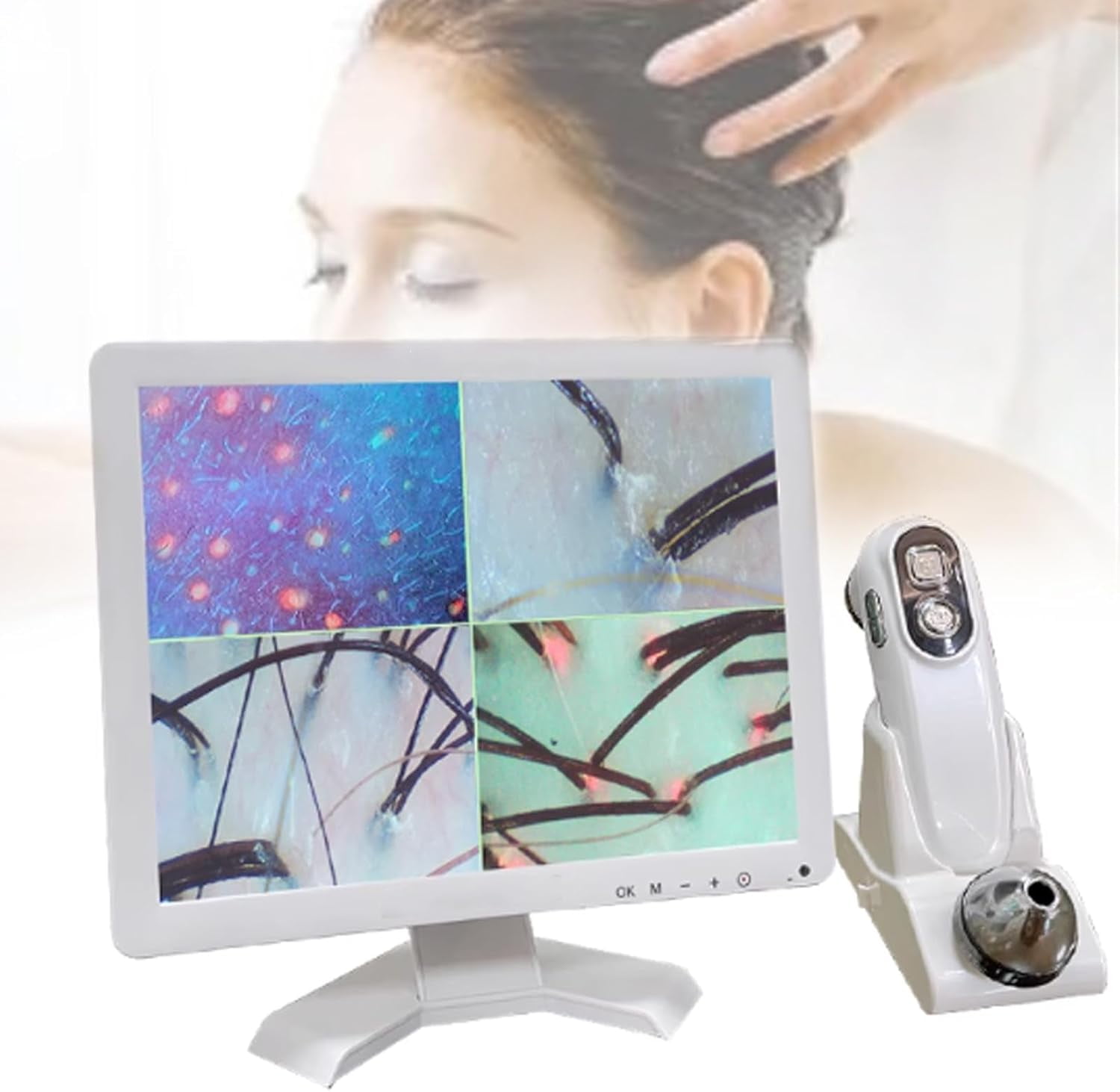 CNV Skin Diagnosis Hair Analyzer,Scalp Hair Follicle Analyzer ...