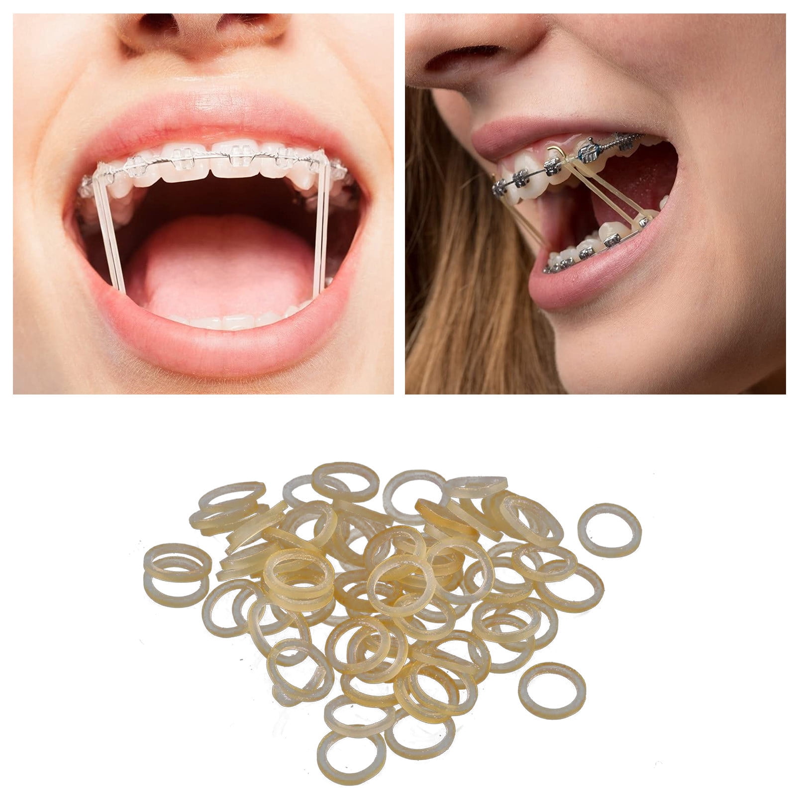 CQININI Tooth Care 100 Pcs Rubber Bands For Teeth Care Teeth Elastics ...