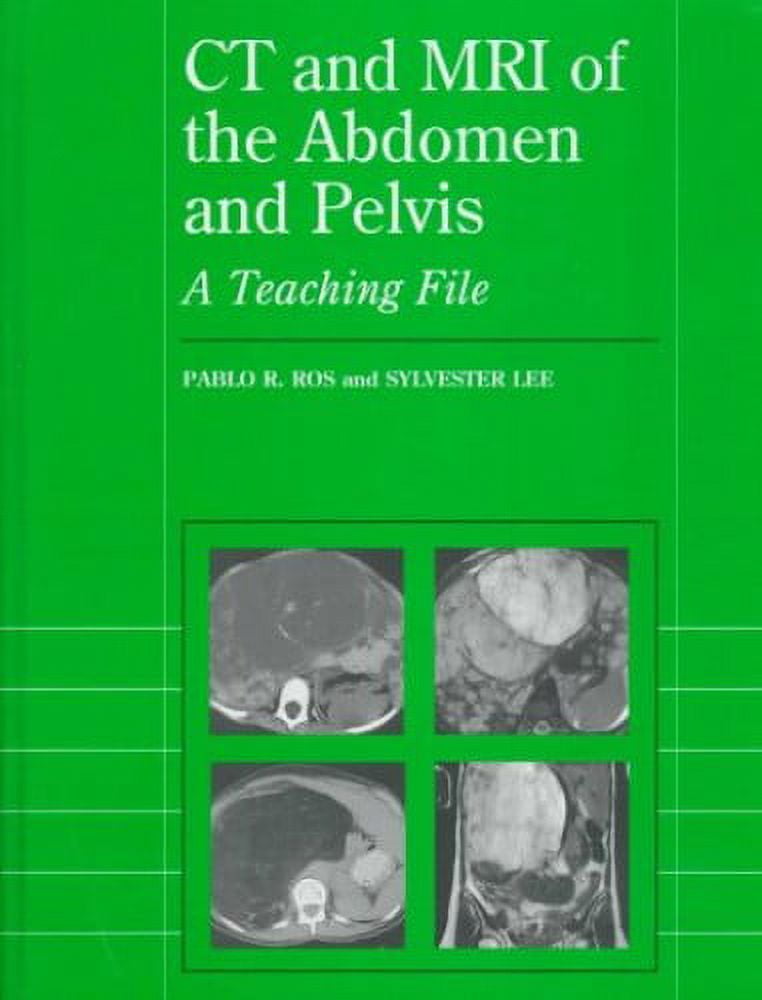 Pre-Owned CT and MRI of the Abdomen and Pelvis: A Teaching File: v. 1 (Radiology Teaching File ...