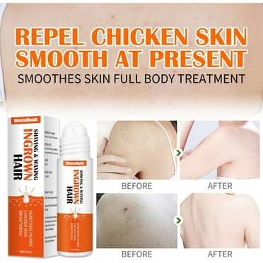 Moom M4Men Hair Remover Refill, 12 Oz - Walmart.com