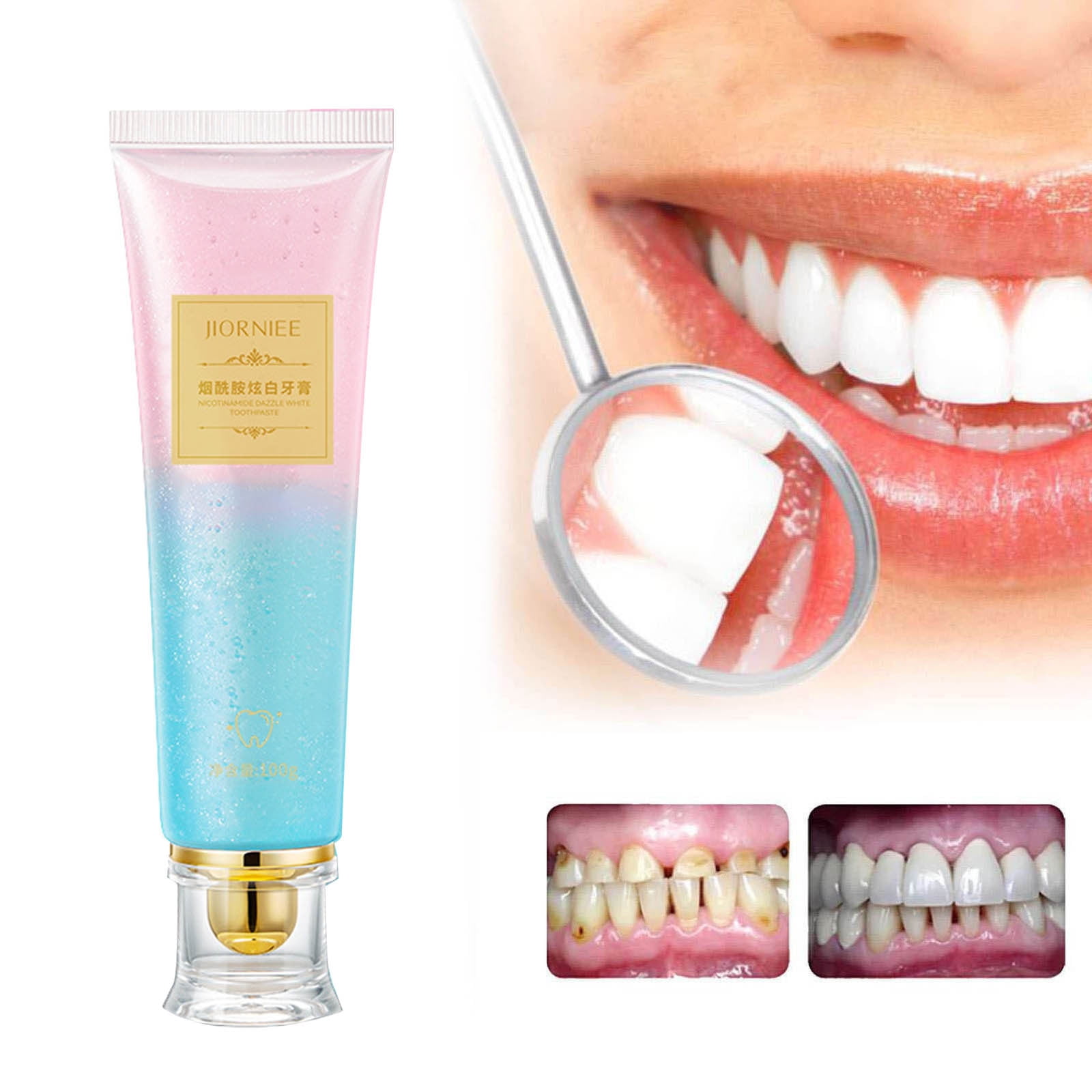 CZESTPYAKE Niacinamide Toothpaste,Niacinamide Intensive Toothpaste ...