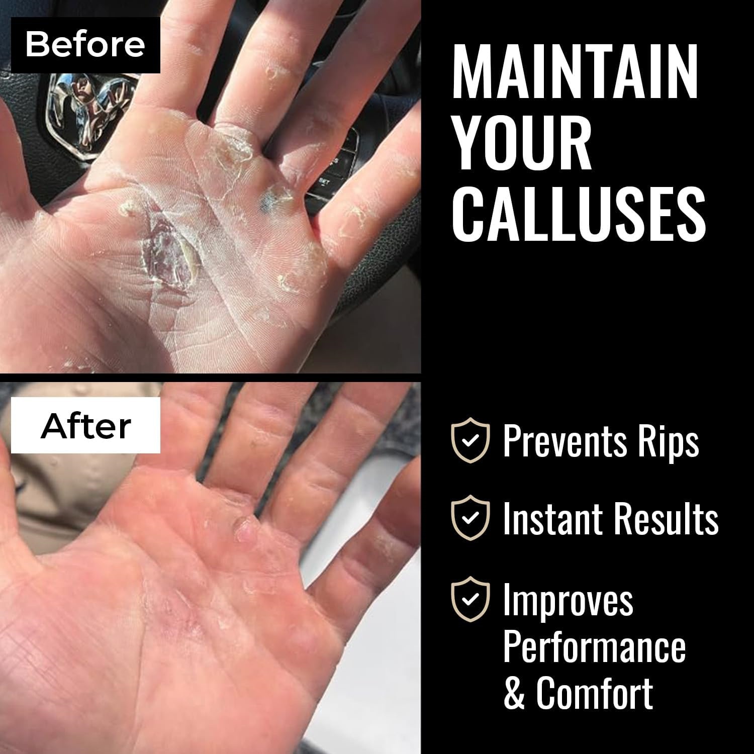 Callus Remover Tool, File for Hands, Durable Aluminum Tool Callus ...