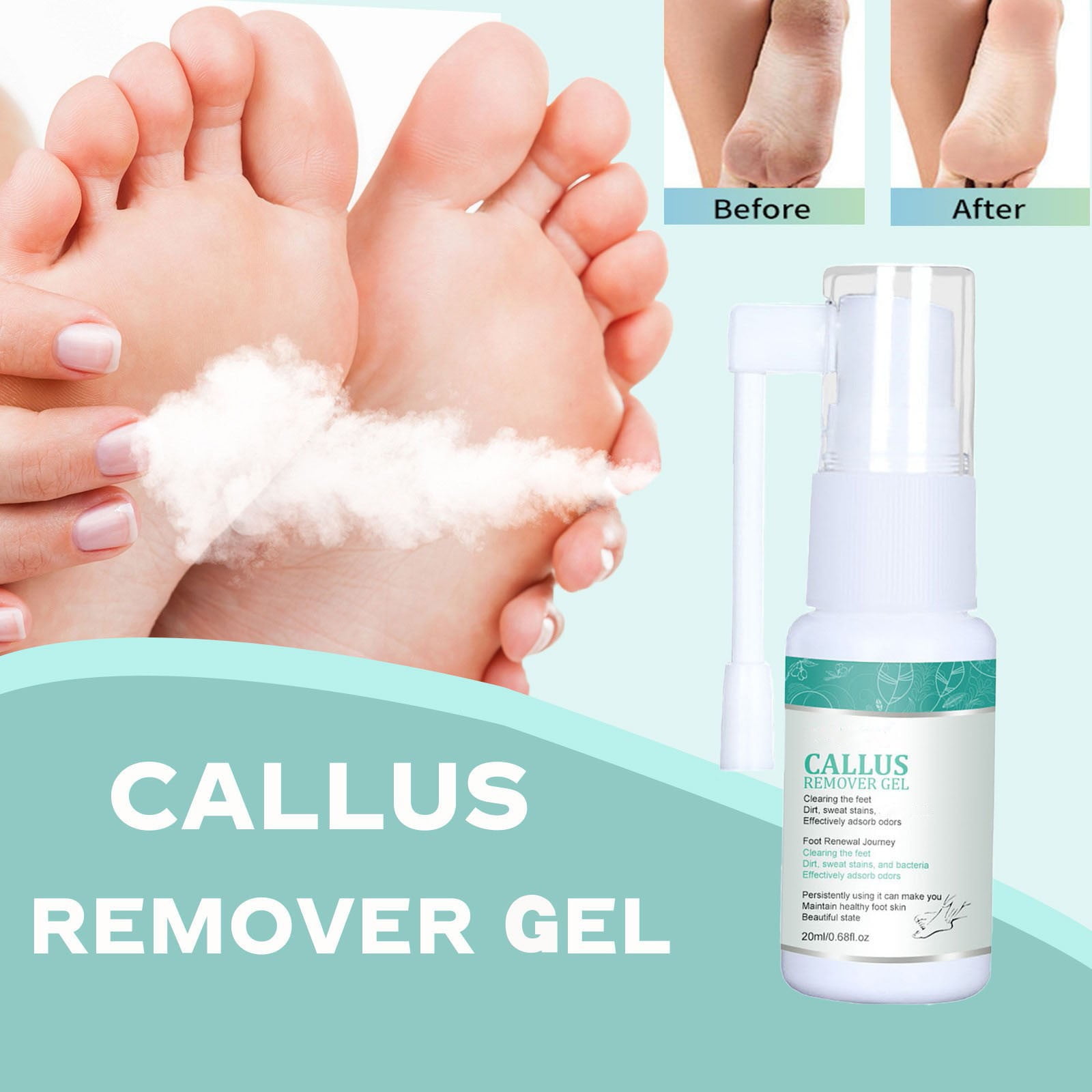 Callus Remover for Feet, Foot Callus Remover Spray, Cleans The Feet ...