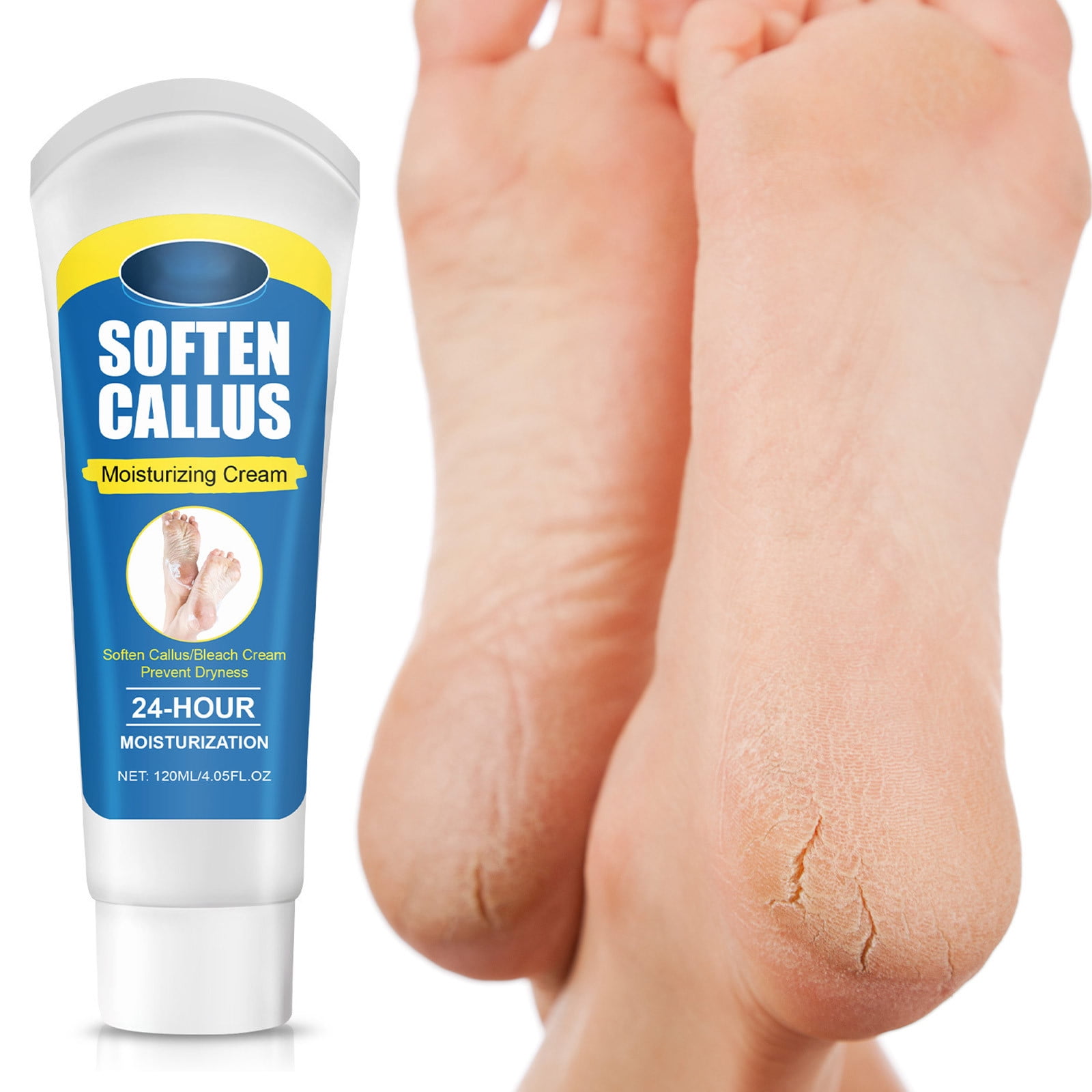 Callus Soften Moisturizing Cream,120ml Jar,Deep Relief,Non-Greasy ...