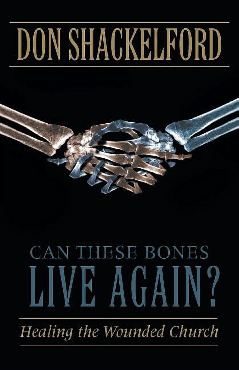 Can These Bones Live Again? : Healing the Wounded Church - Walmart.com