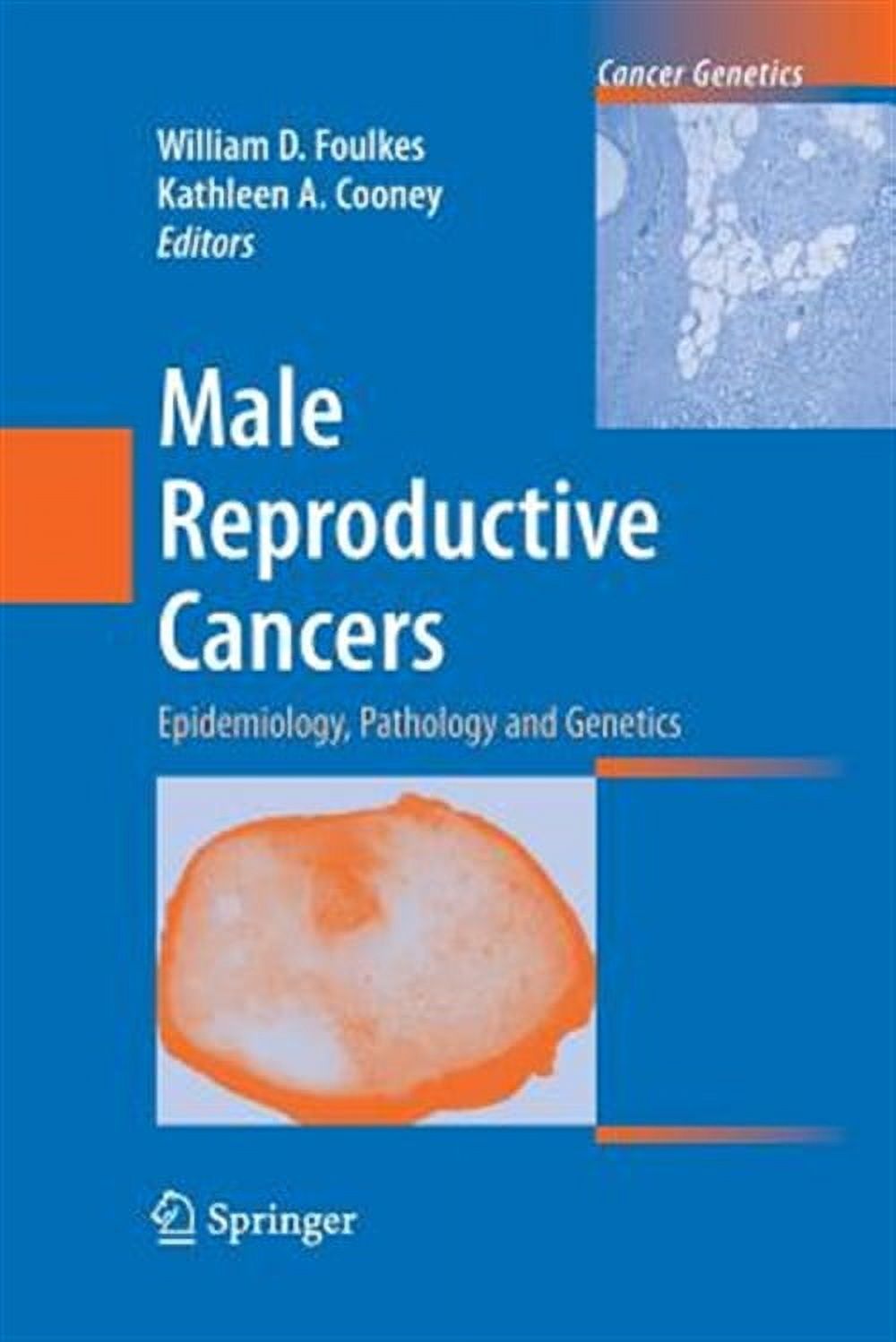 Cancer Genetics: Male Reproductive Cancers: Epidemiology, Pathology and ...