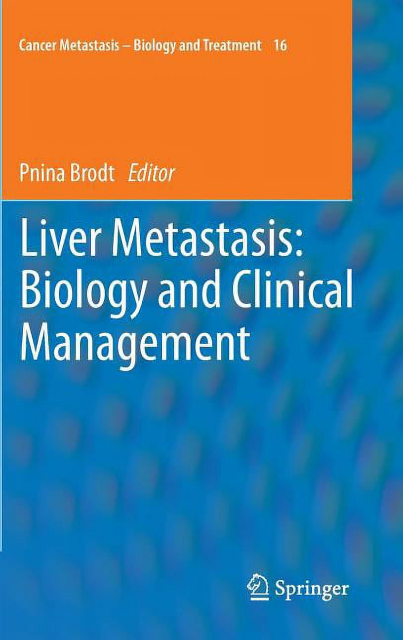 Cancer Metastasis - Biology and Treatmen Liver Metastasis: Biology and ...