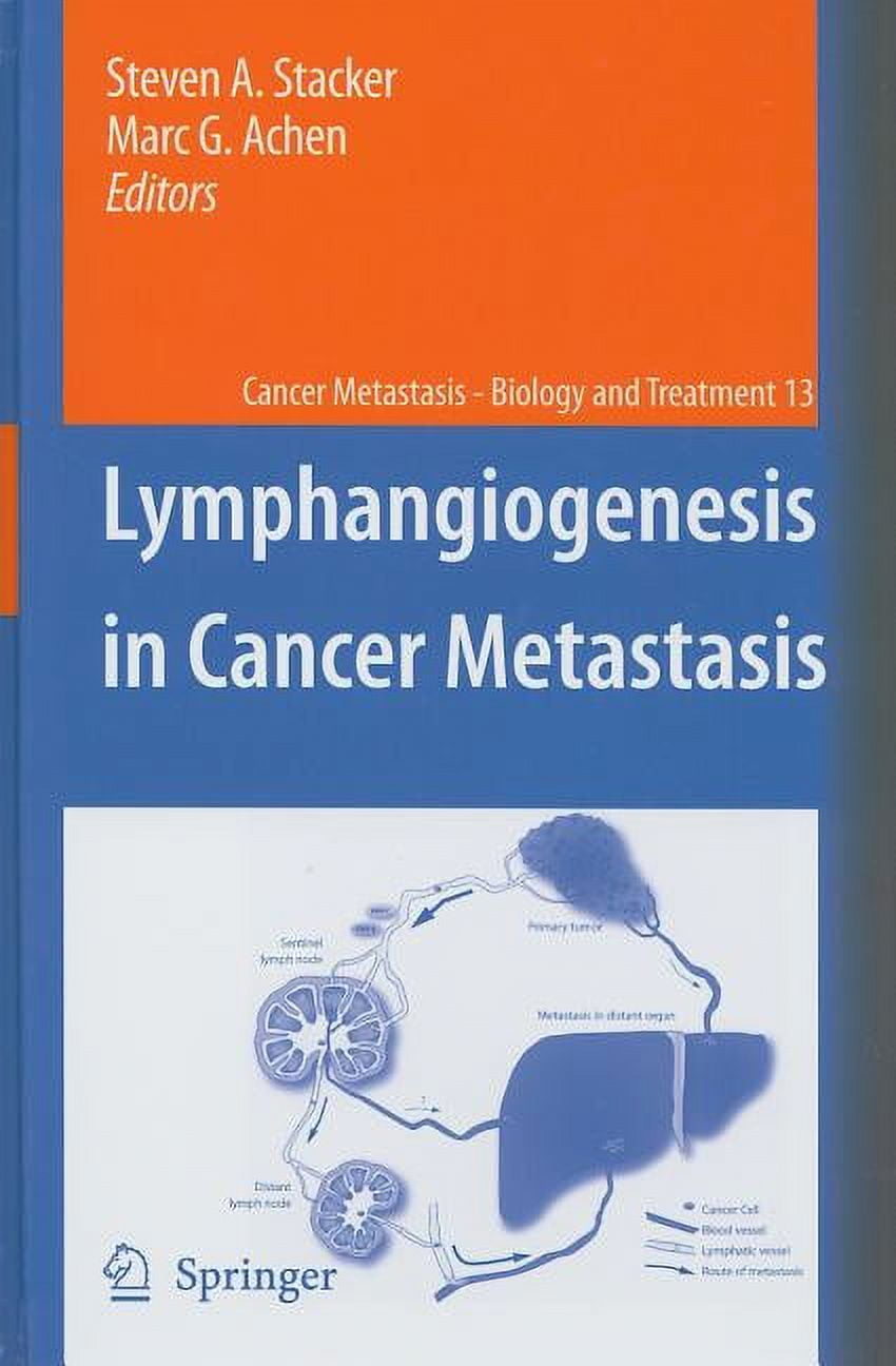 Cancer Metastasis - Biology and Treatment: Lymphangiogenesis in Cancer ...
