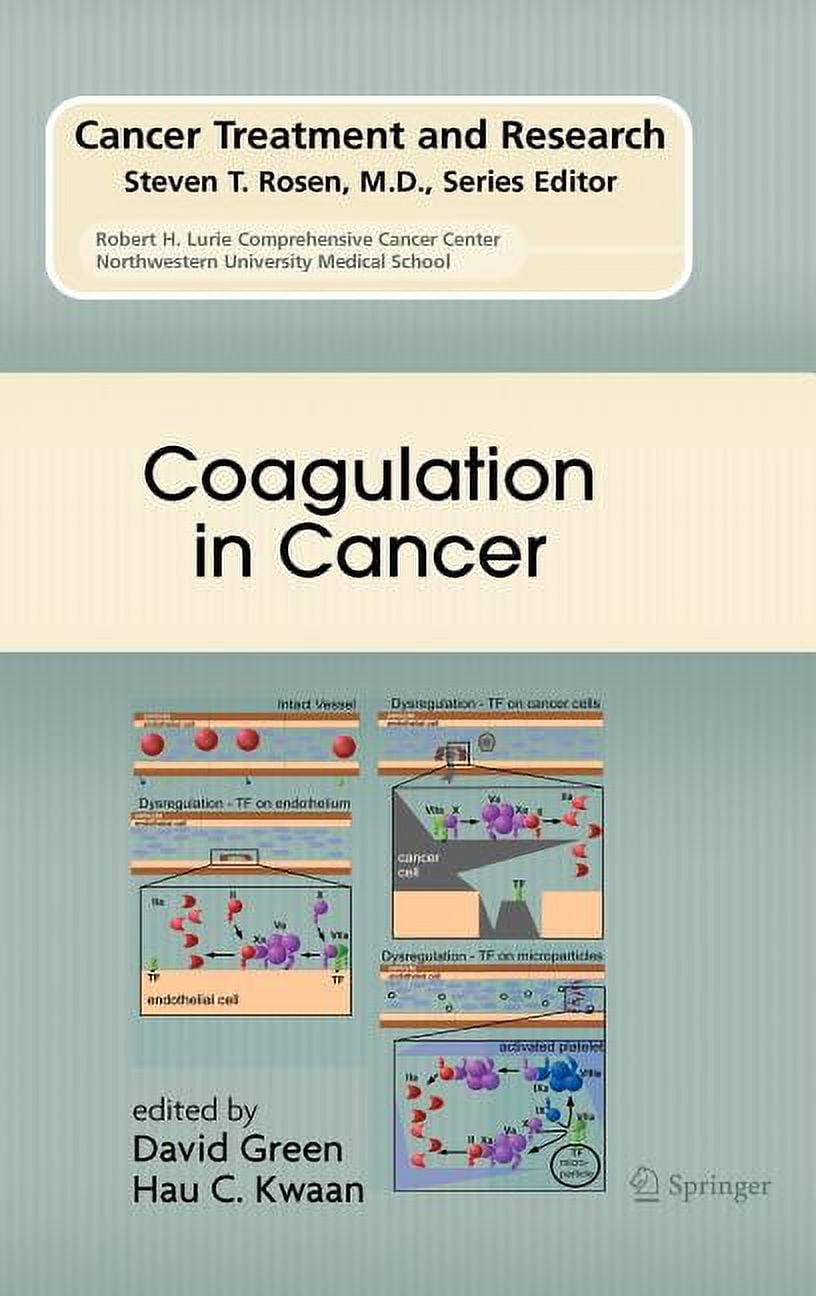 Cancer Treatment and Research Coagulation in Cancer, Book 148 ...
