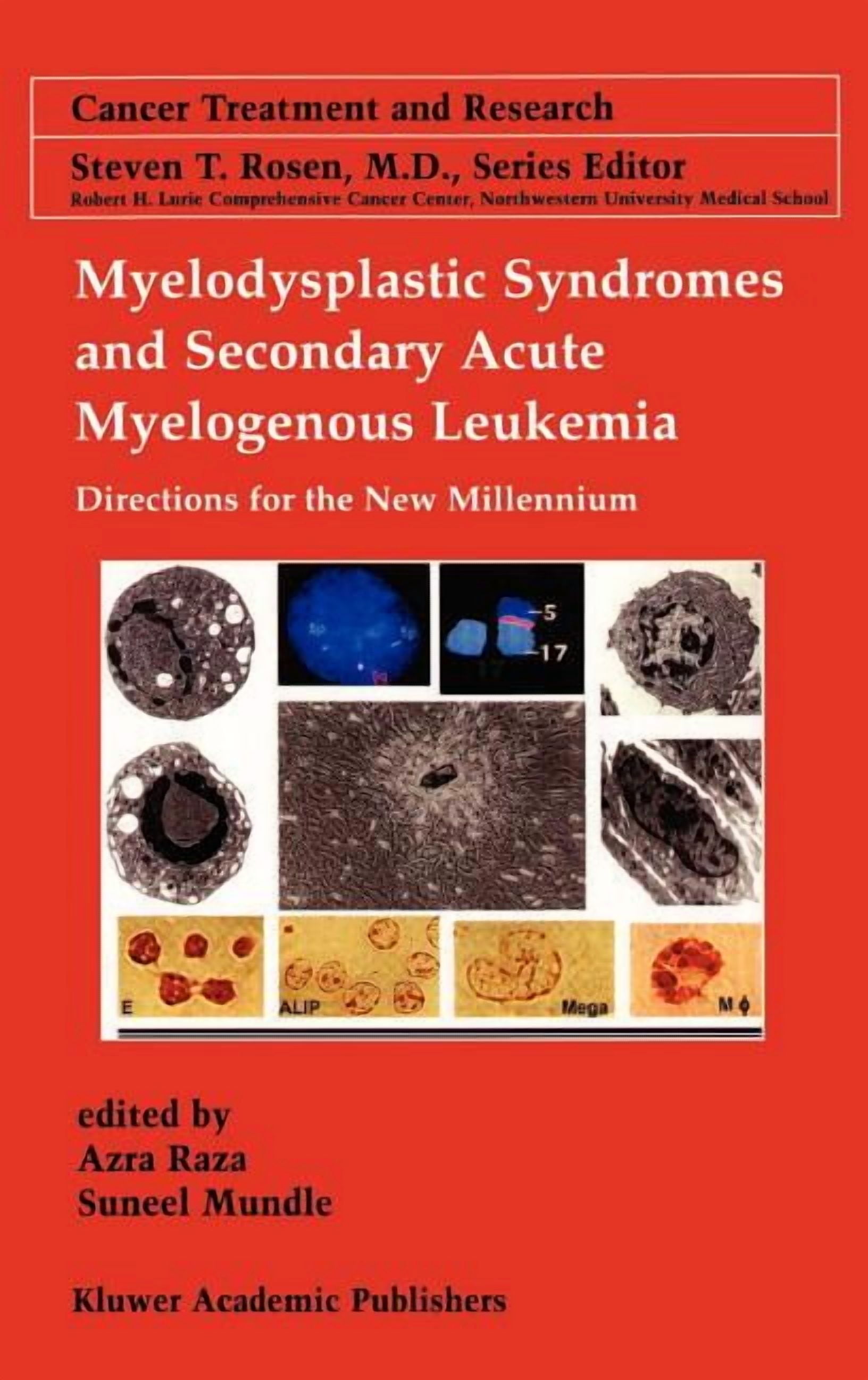 Cancer Treatment and Research Myelodysplastic Syndromes & Secondary ...
