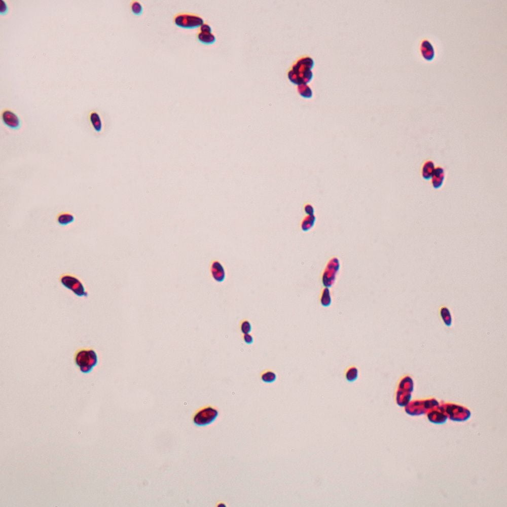Candida Albicans, W.M. Microscope Slide - Walmart.com