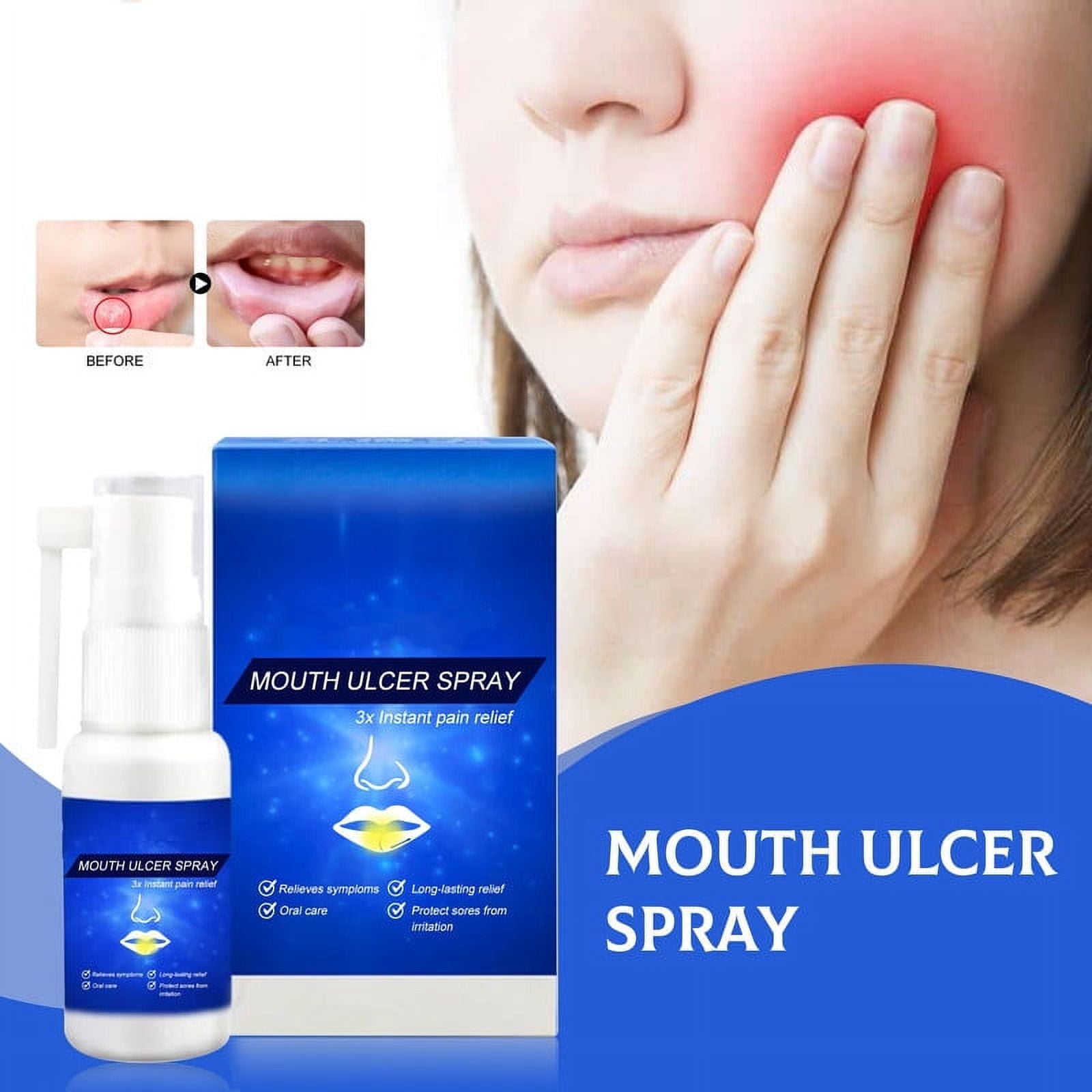 Canker Relief Spray,Breath Spray for Bad Breath,Herbal Mouth Spray ...