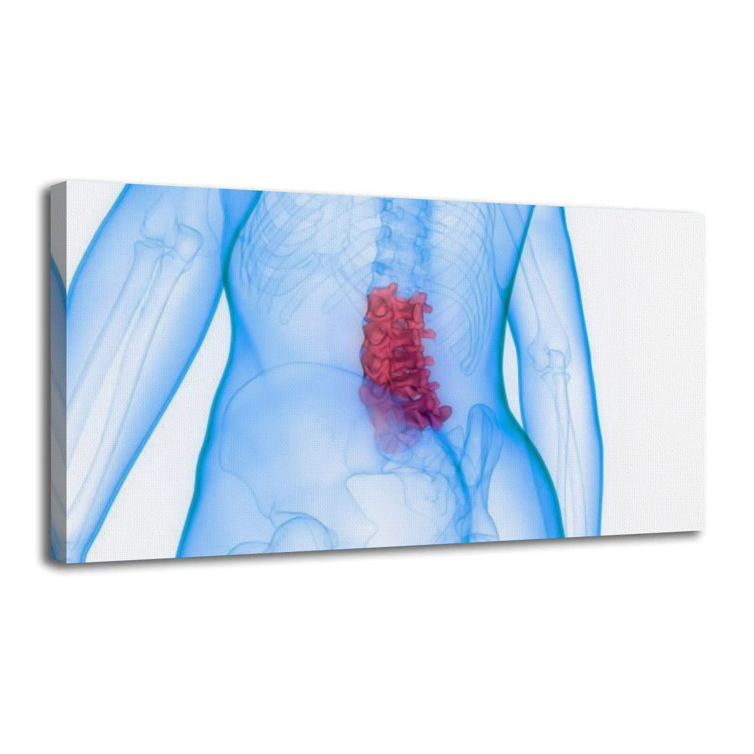 Canvas Wall Art Human Vertebral Column Lumbar Spine Anatomy Wall Decor ...