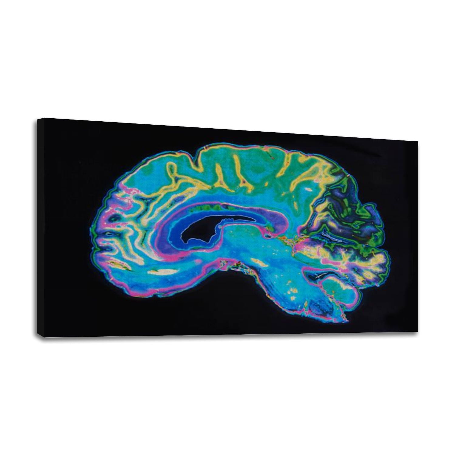 Canvas Wall Art MRI Brain Black Wall Decor for Living Room Bathroom ...