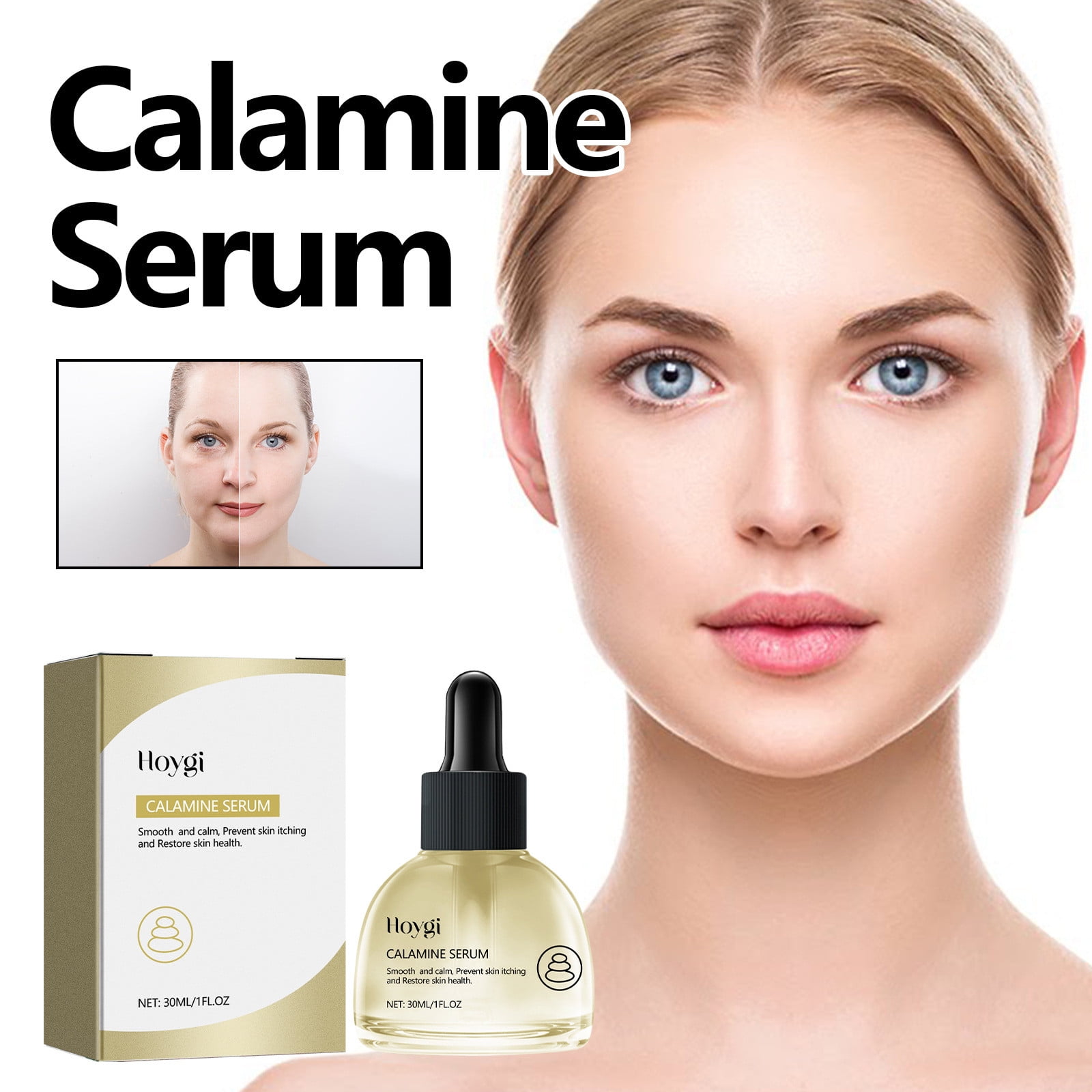 Capebale Facial Skin Care Products, Calamine Serum Centella Asiatica ...
