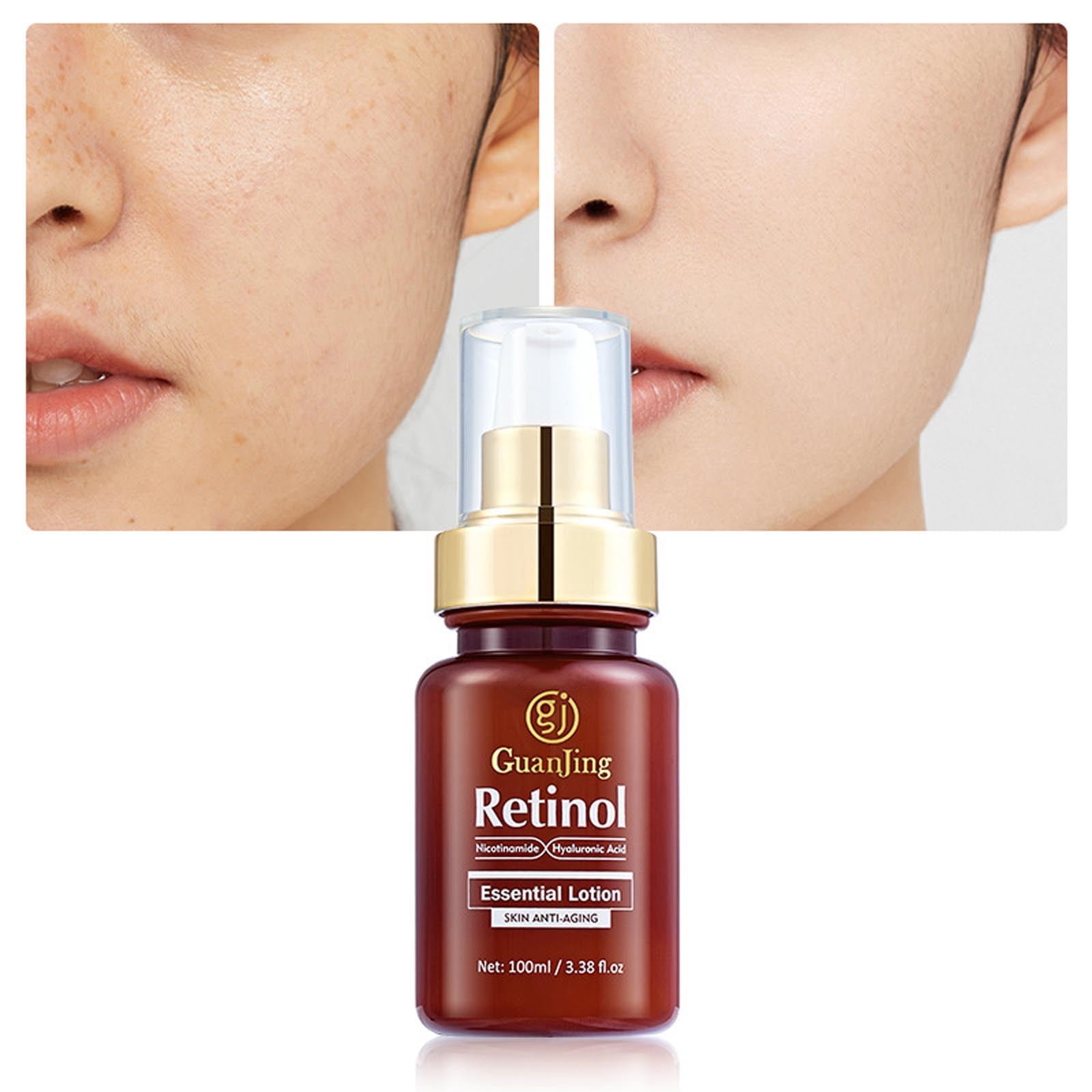 Capebale Retinol Serum, Retinol Essence Milk Fade Fine Lines Bouncy ...