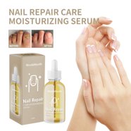 COCEQUC CHLOEF 10ml Paronychia Relief Oil Ingrown Toenail Correction ...