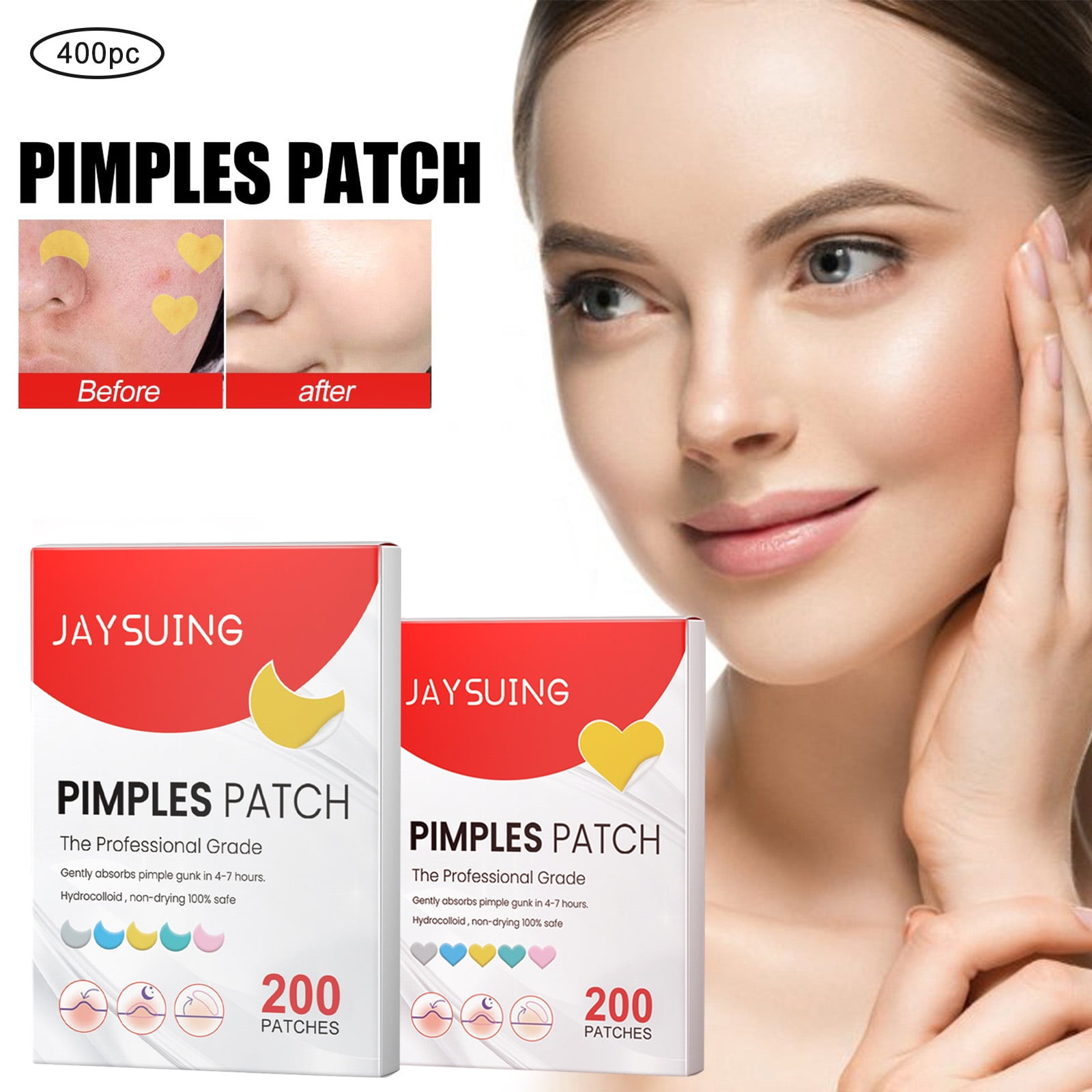 Cara Lady Pimple Patches for Face,Colorful Cute Zit Covers,Hydrocolloid ...