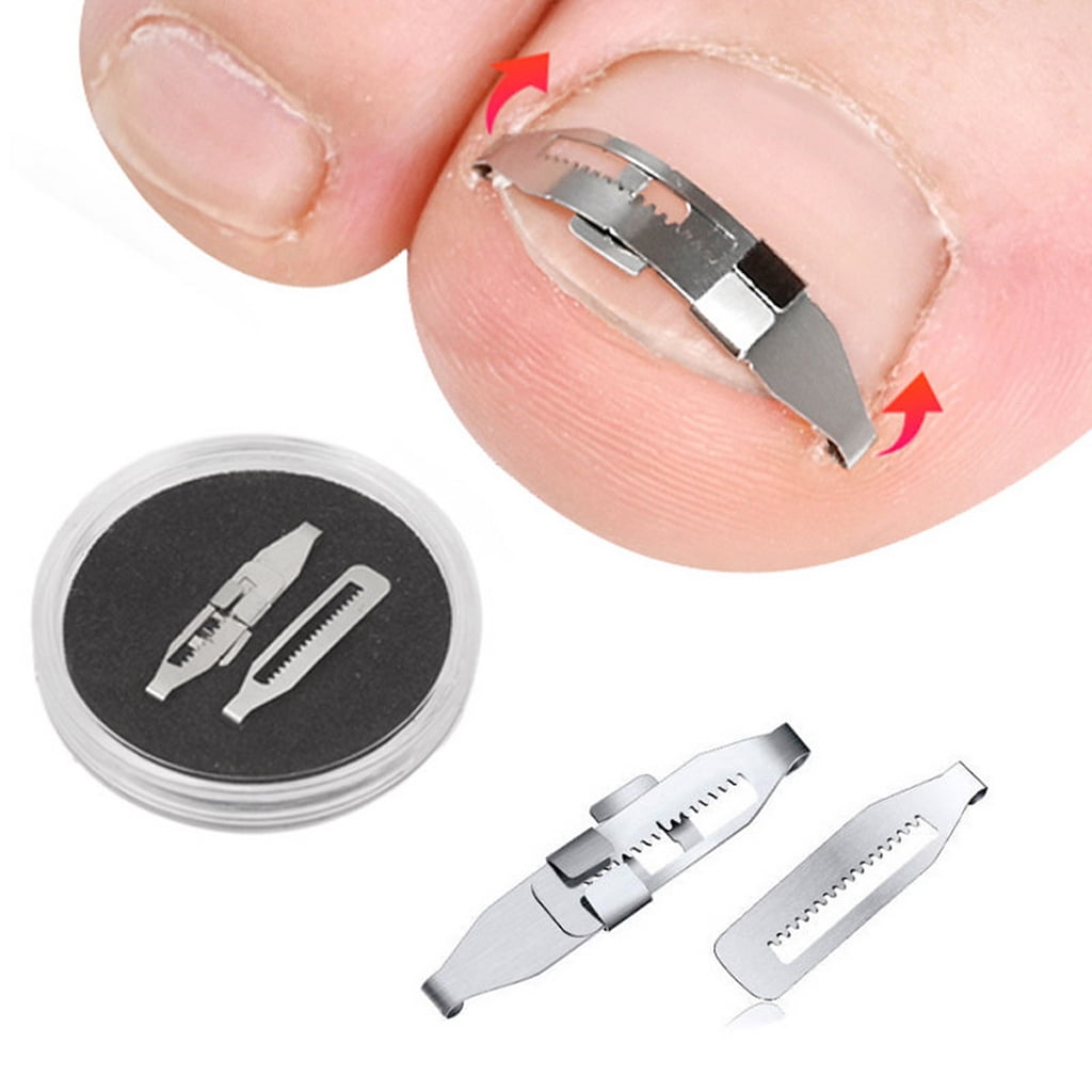 Carbon steel Ingrown Toenail Pedicure Tool Straightening Correction ...