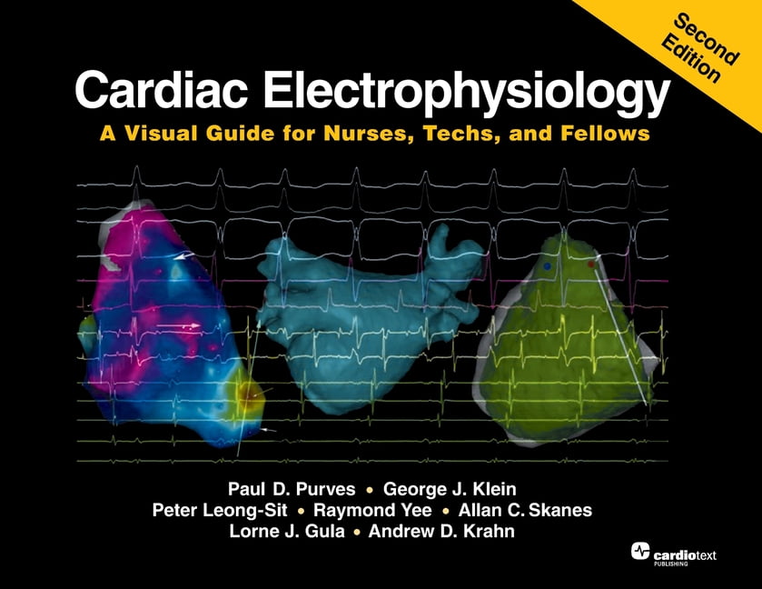 Cardiac Electrophysiology: A Visual Guide for Nurses, Techs, and ...