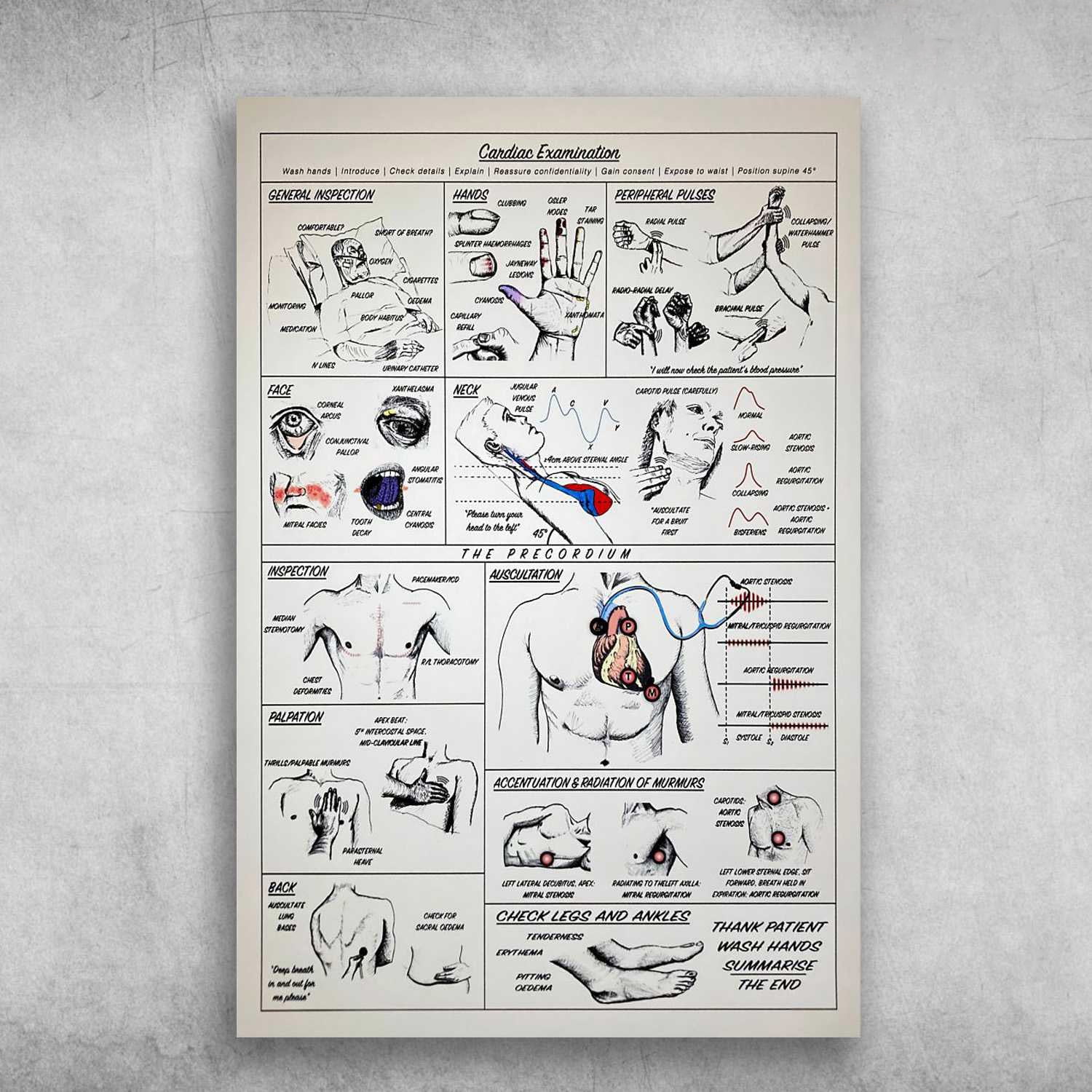 Cardiac Examination, General Inspection, Peripheral Pulses, Check Legs ...