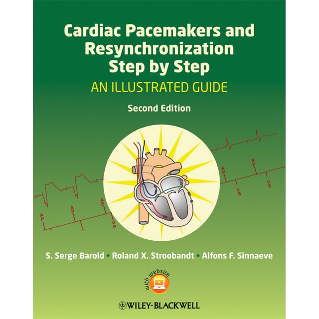 Cardiac Pacemakers and Resynchronization Step by Step: An Illustrated ...