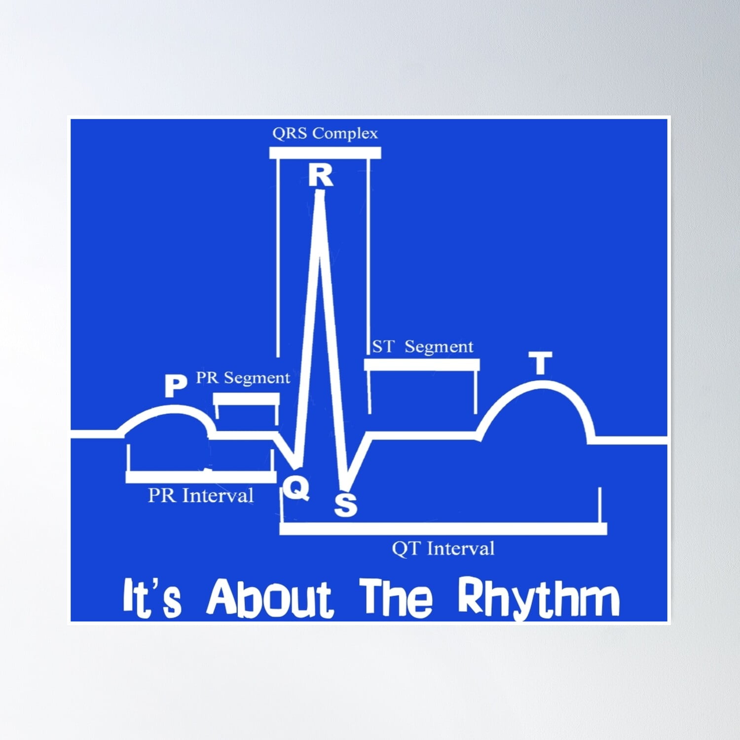 Cardiac St Segment Poster Wall Art, Modern Wall Decor, 12x18 UNFRAMED ...