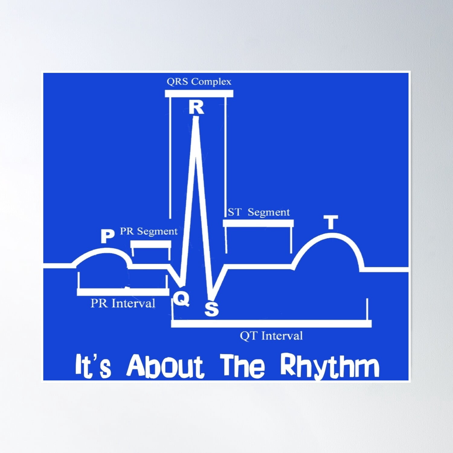 Cardiac St Segment Poster Wall Art, Modern Wall Decor, 8x12 UNFRAMED ...