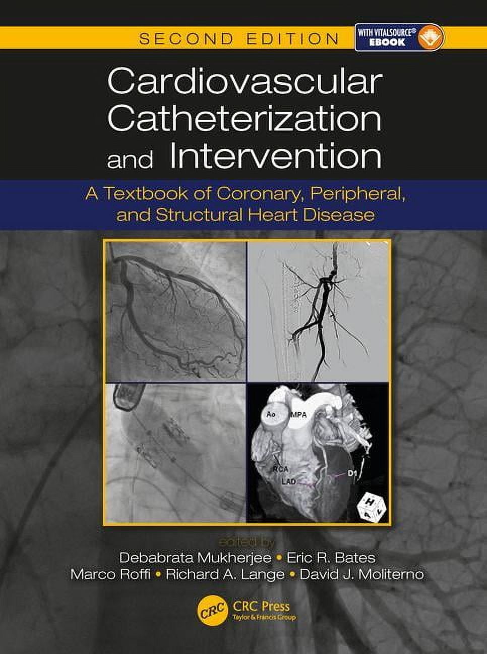 Cardiovascular Catheterization and Intervention: A Textbook of Coronary ...
