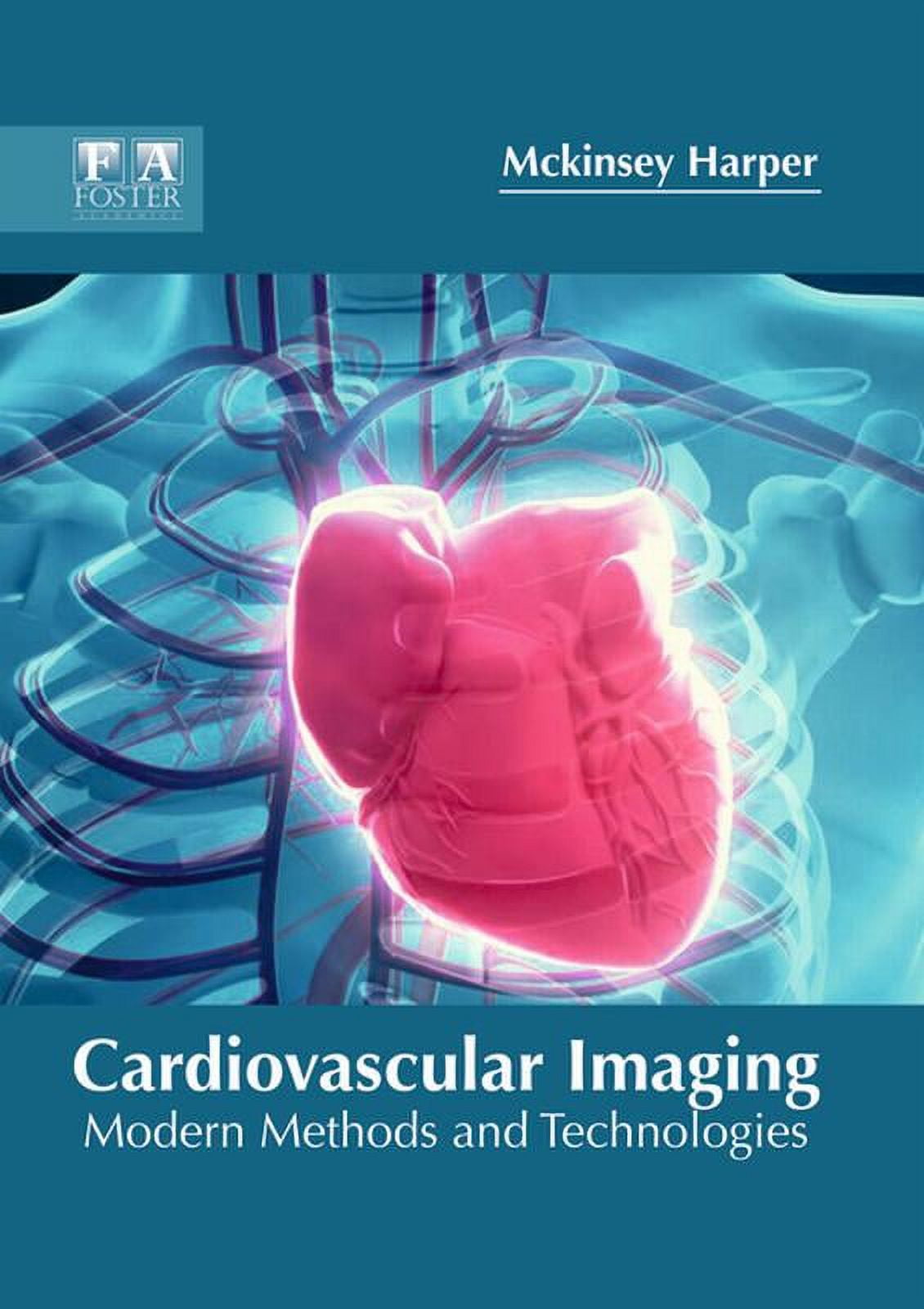 Cardiovascular Imaging: Modern Methods and Technologies, (Hardcover ...
