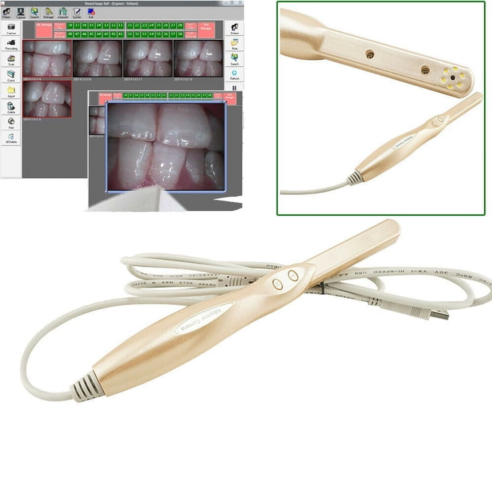 Carejoy Dental Intraoral Intra Oral Camera Dynamic 6-LED 4 Mega Pixels ...