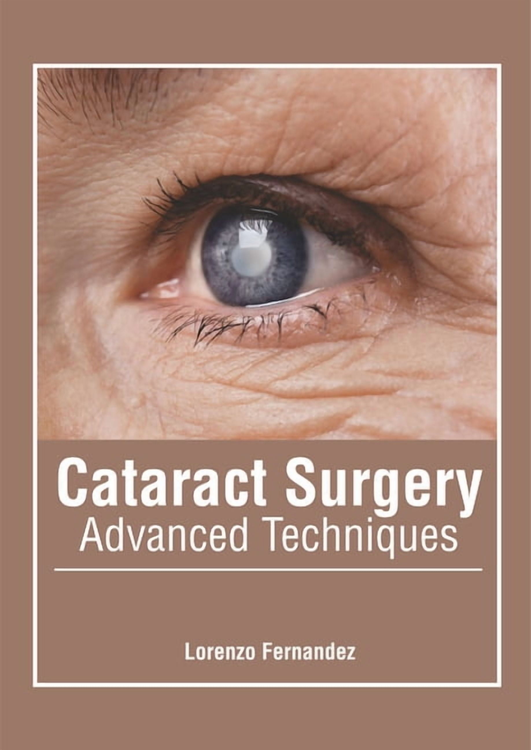 Cataract Surgery: Advanced Techniques, (Hardcover) - Walmart.com