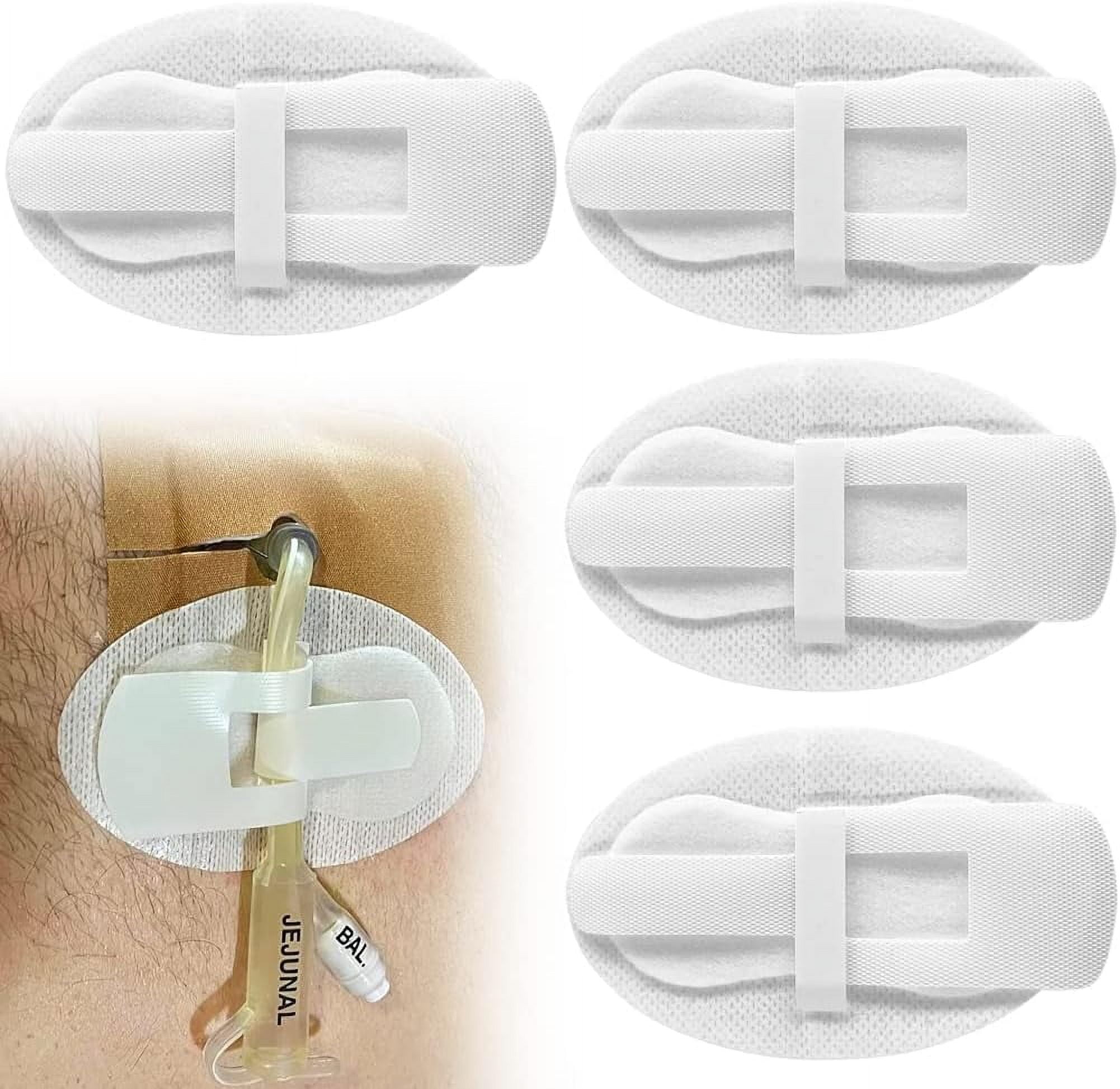 Catheter Stabilization Device Feeding Tube Holders PD Dialysis Patch ...