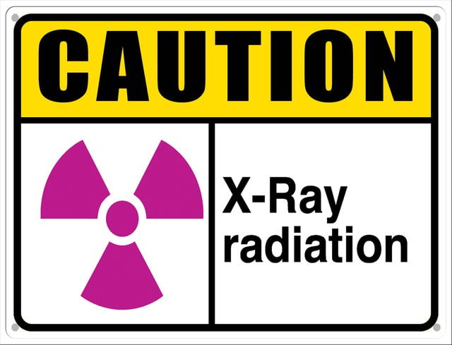 Caution Sign X Ray Radiation Aluminum Tin Sign For Home Coffee Bar Wall ...