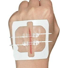 Zipstitch Laceration Kit