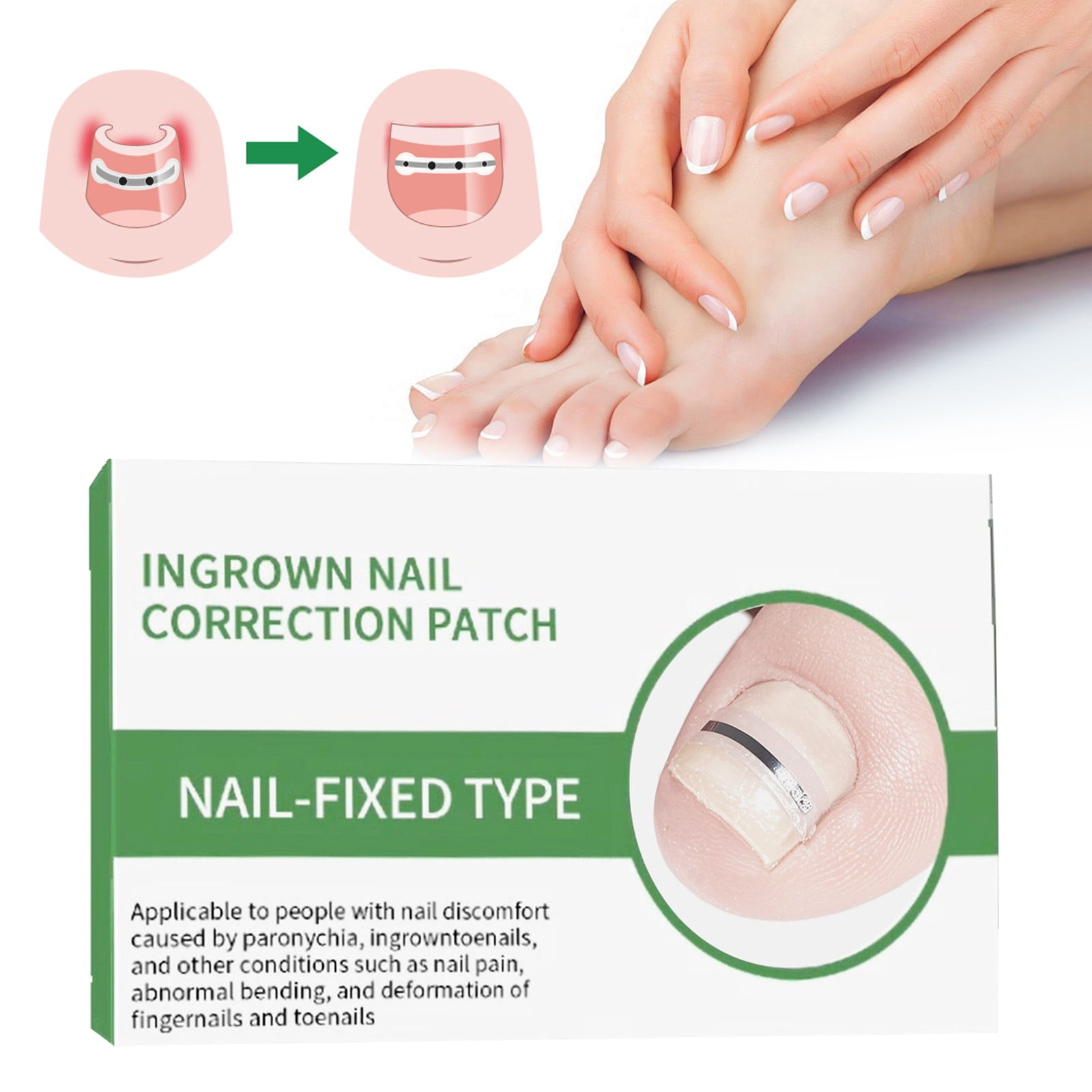 Celebrate Easter! Titanium Alloy Toenail Nail Tools And Toenail Removal ...