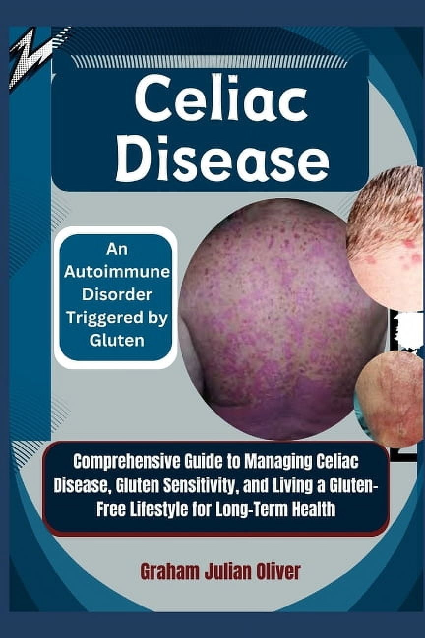 Celiac Disease: An Autoimmune Disorder Triggered by Gluten ...
