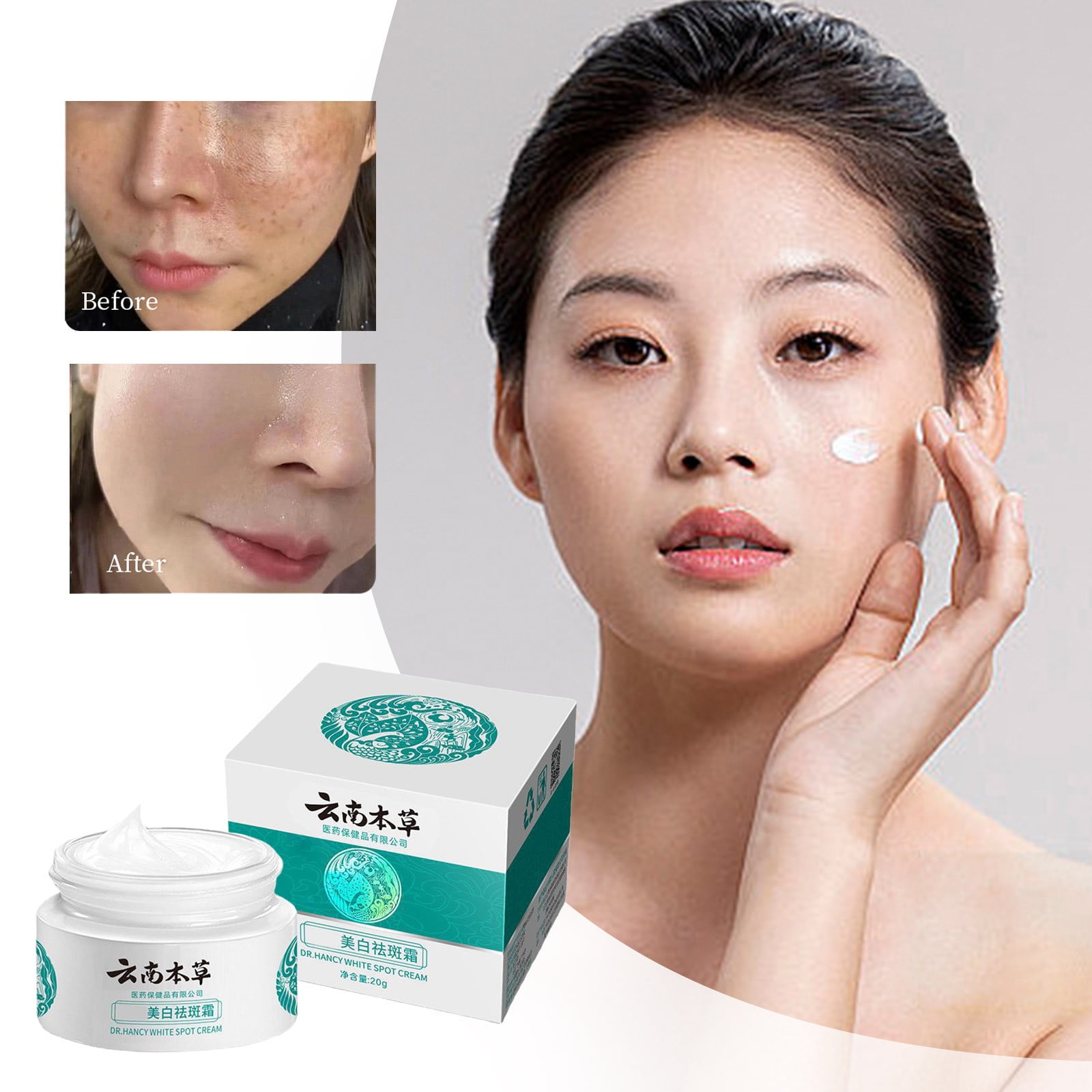 Chailin 20g Japanese Melasma Japanese Melasma Japanese Kasumi Abera ...