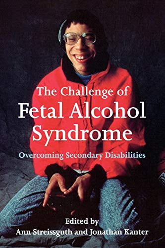 Pre-Owned The Challenge of Fetal Alcohol Syndrome : Overcoming ...