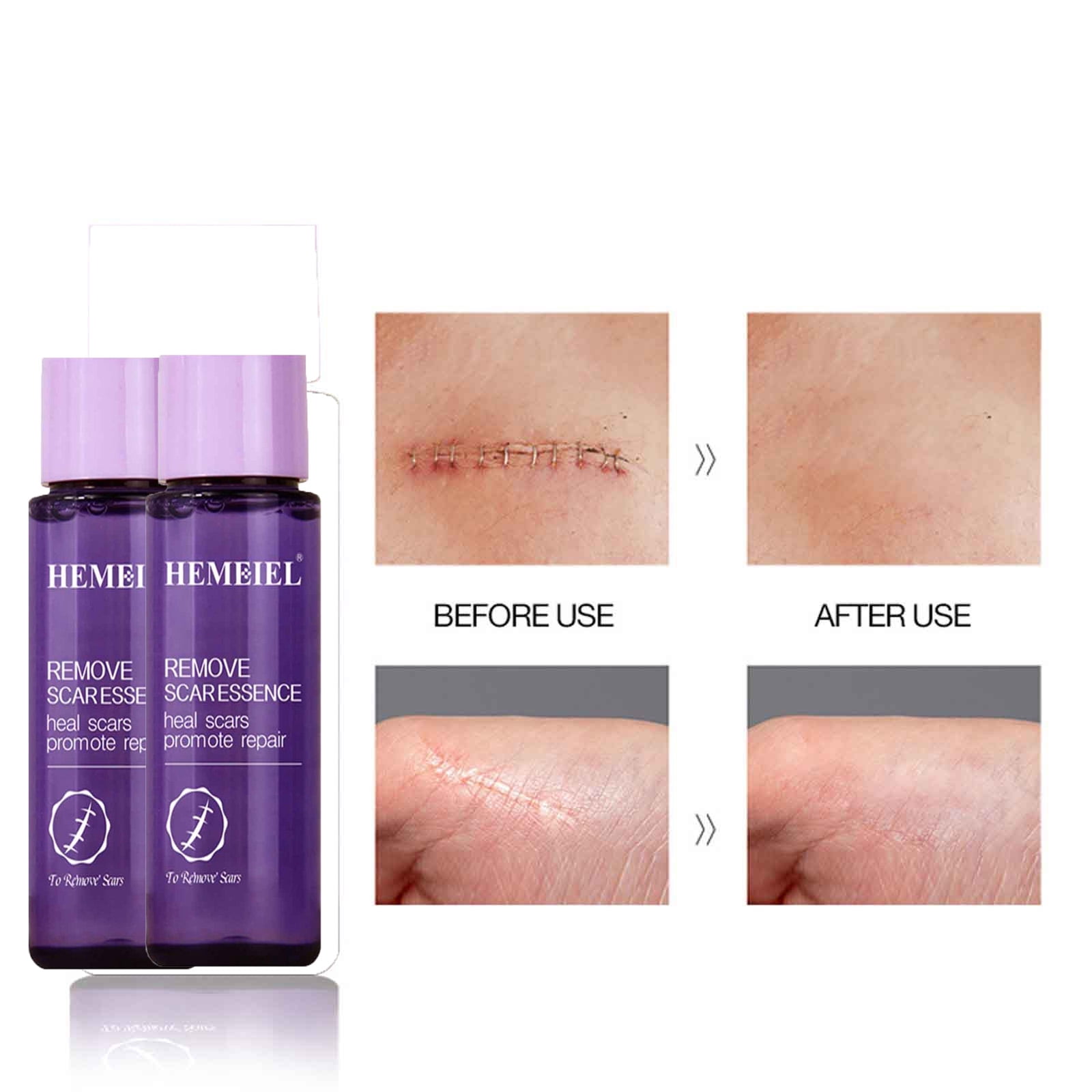 Chamoist Remove scars essence,Remove Scars Body Heal scars promote ...