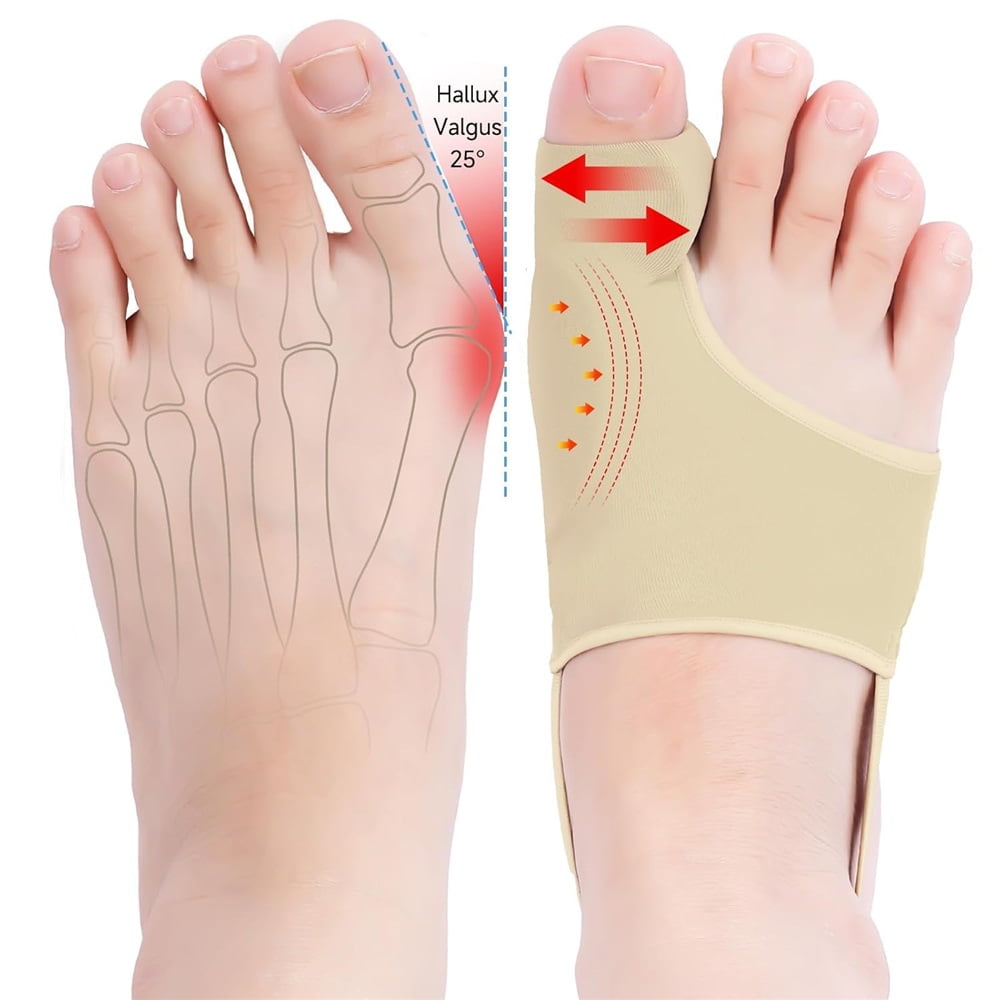 Changmaius Bunion Corrector for Women Big Toe - Adjustable Non-Surgical ...