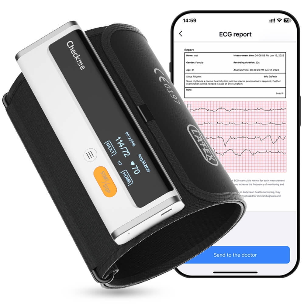 Checkme BP2 Bluetooth Blood Pressure Monitor With AI EKG Analysis ...
