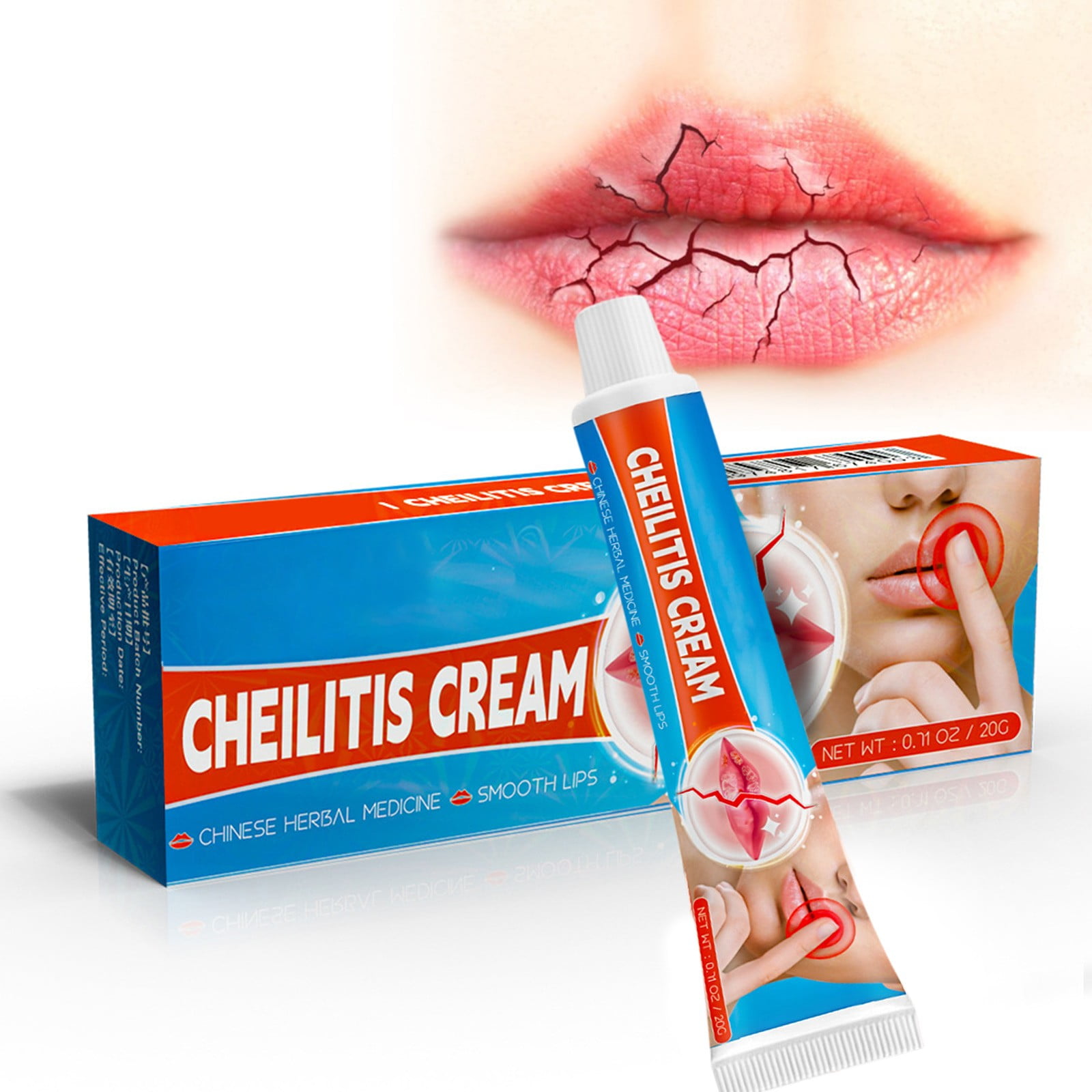 Cheilitis Balm Chapped Lips Lip Balm For Men Women And Kids Cheilitis ...