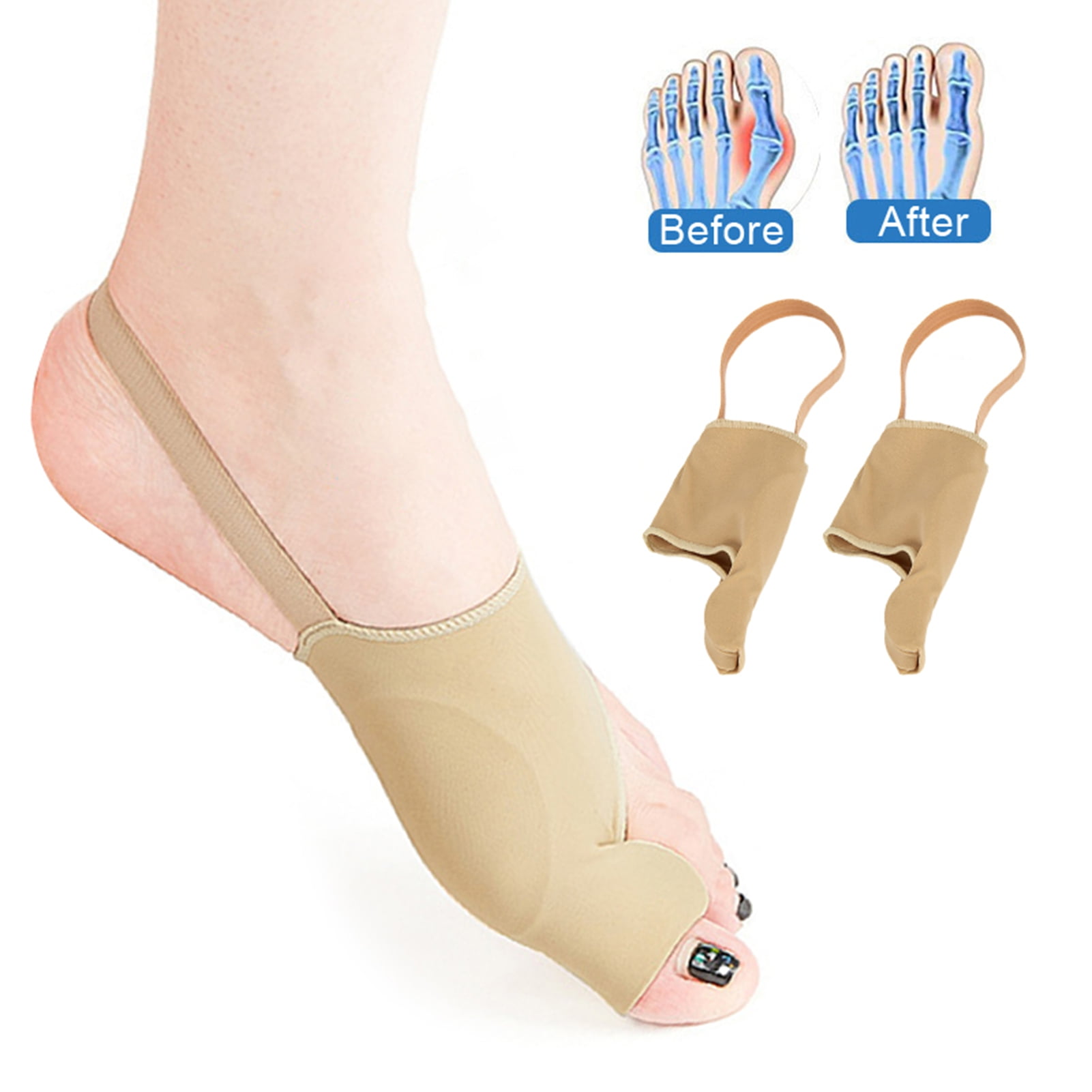 CherryHome Toe Corrector Hallux Valgus Pain Relief Foot Surgery ...