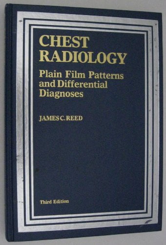 Pre-Owned Chest Radiology: Plain Film Patterns and Differential ...
